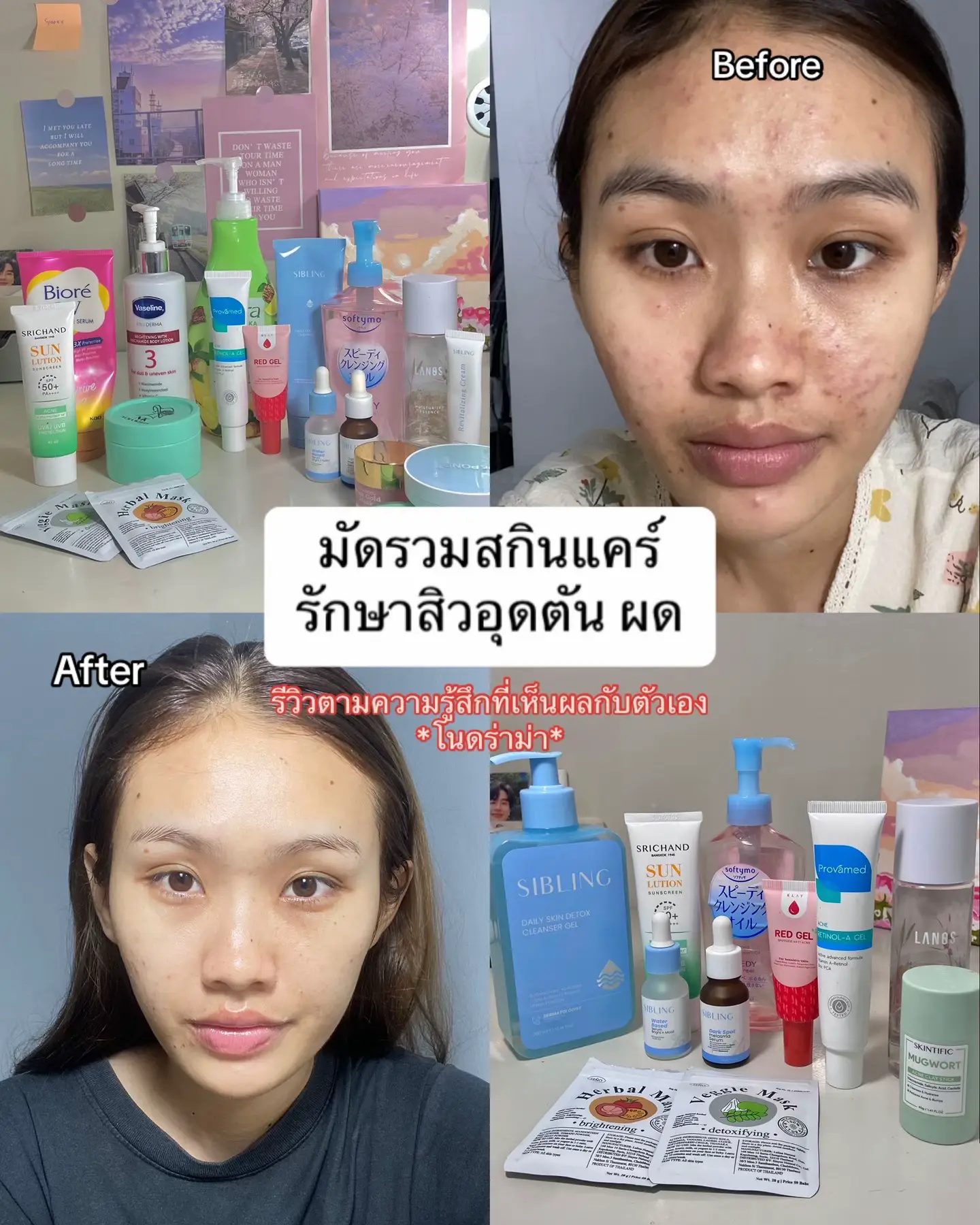 มัดรวมสกินแคร์ ใช้แล้วชอบ ซื้อซ้ำ 💗 | แกลเลอรีที่โพสต์โดย pimploy𐙚 | Lemon8