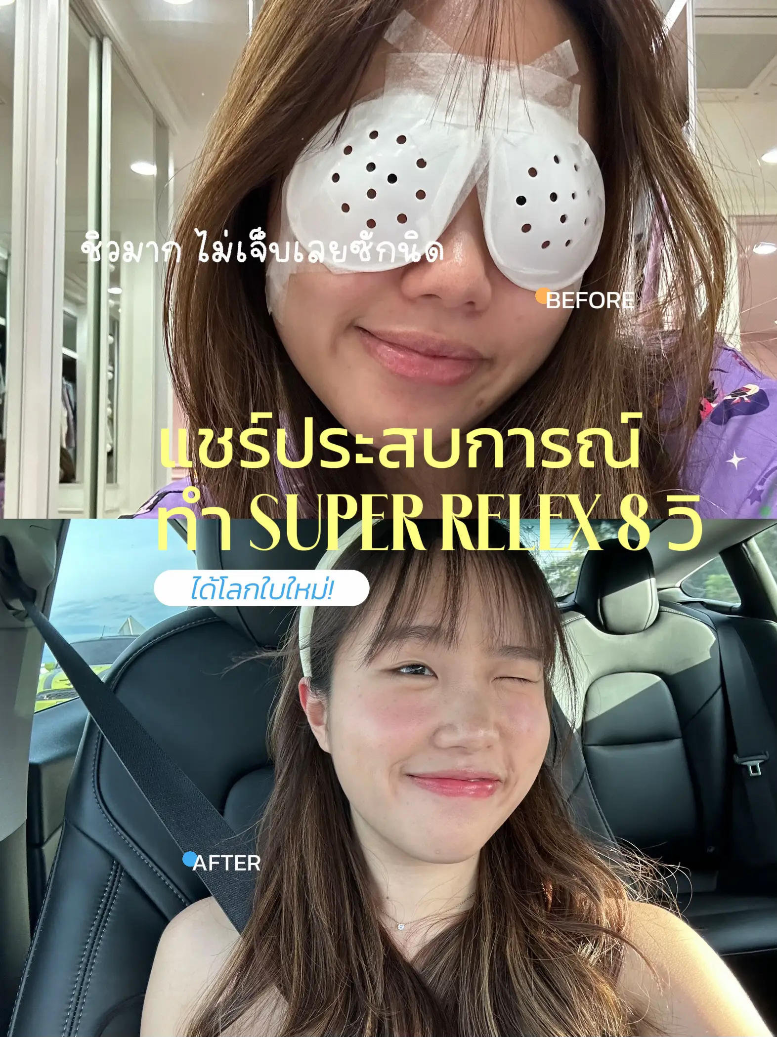 แชร์ประสบการณ์ทำSUPER RELEXเหมือนได้โลกใบใหม่ใน8วิ👀 | แกลเลอรีที่โพสต์โดย Bambie | Lemon8