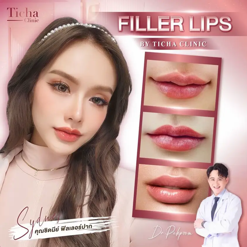 ทรงปากมาแรง เซฟไว้เป็นRef.ได้เลยค่ะ | แกลเลอรีที่โพสต์โดย Ticha Clinic | Lemon8