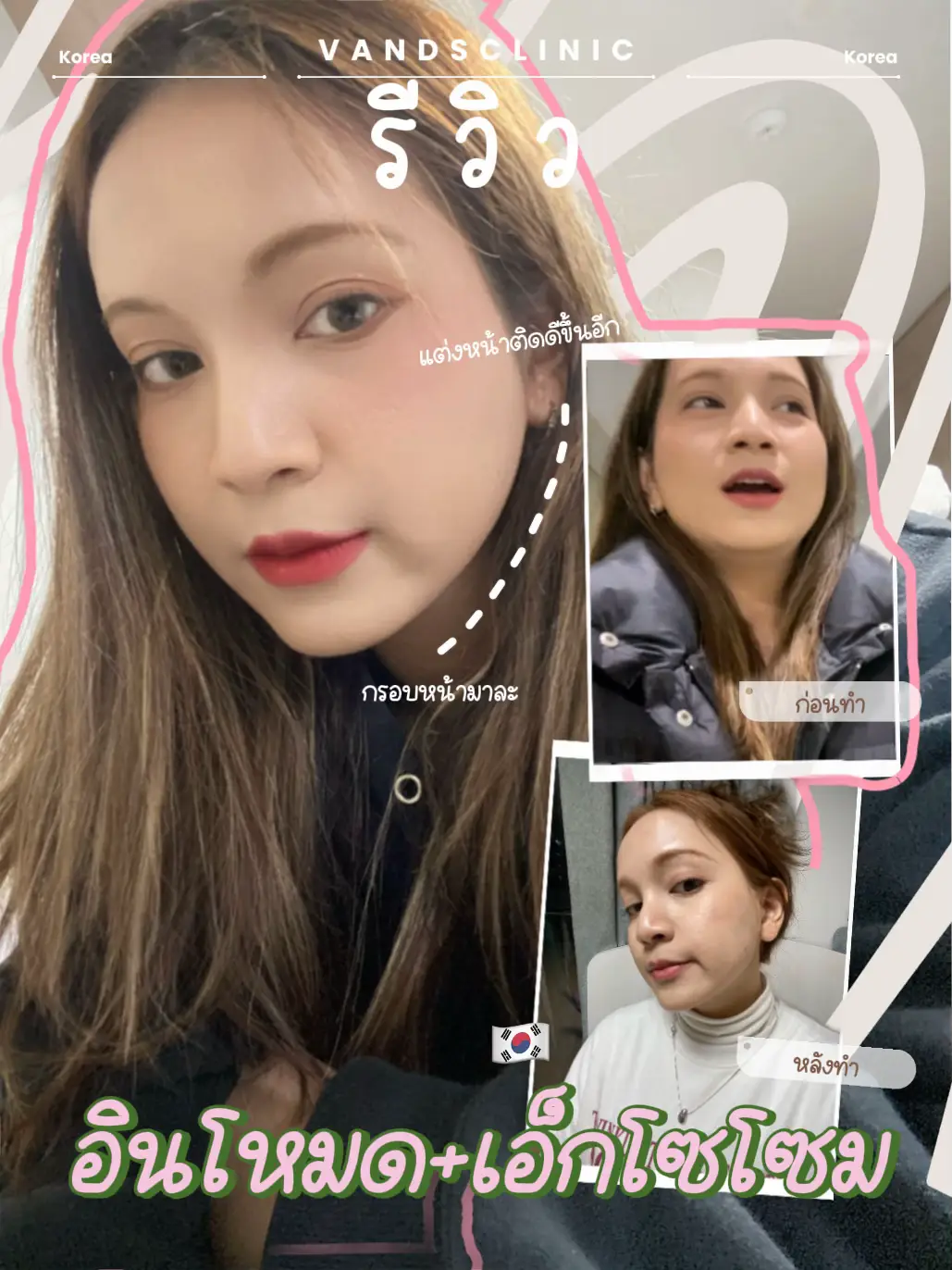 จิ้มหน้ารับปีใหม่ 🇰🇷รอบนี้ลอง VANDSCLINIC | แกลเลอรีที่โพสต์โดย เยริมิเยม• | Lemon8