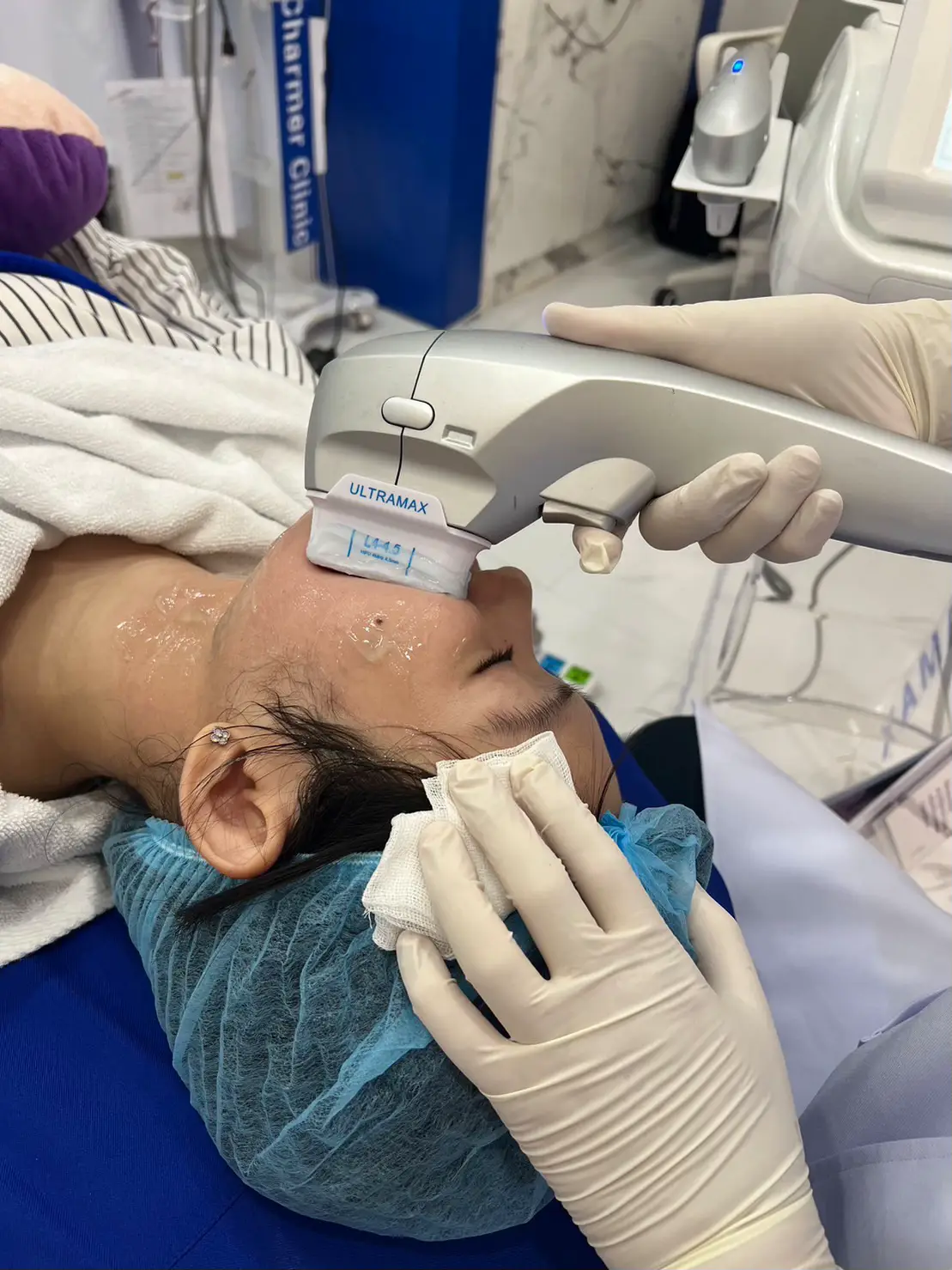 รีวิว ultramax hifu - การค้นหาใน Lemon8