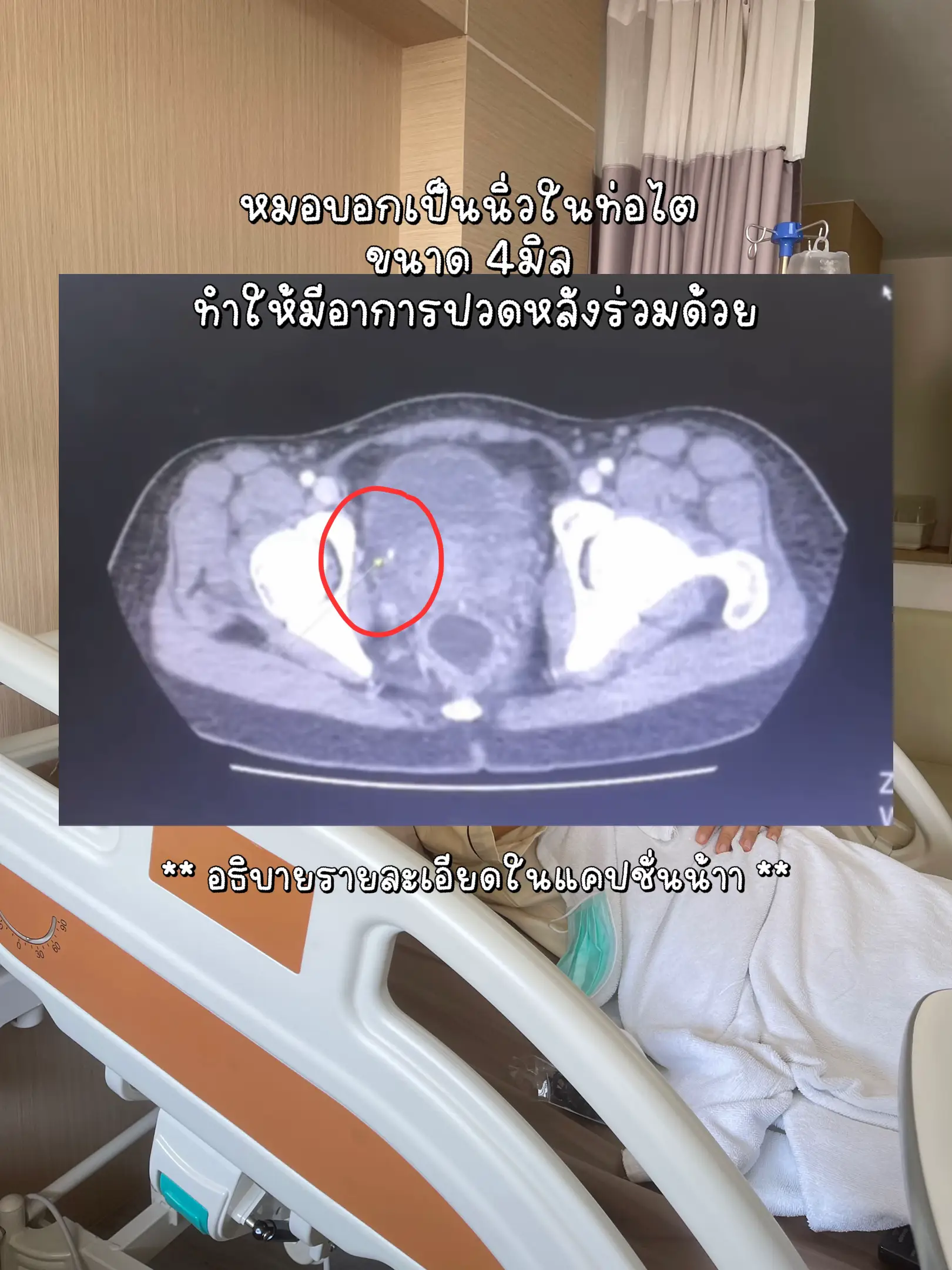 อุทาหรณ์คนกินน้ำน้อย 🚫 | แกลเลอรีที่โพสต์โดย AOMMii ̎ | Lemon8