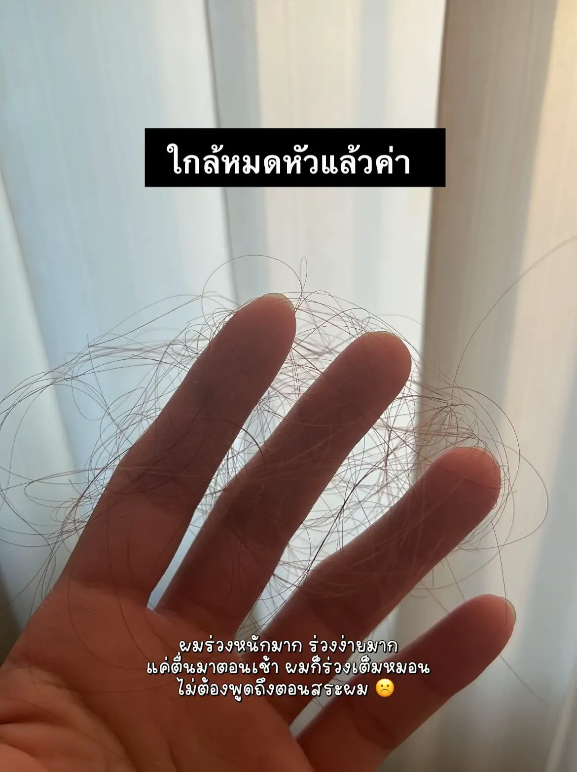 19 ไอเดียยอดนิยมเกี่ยวกับ ลดบวม Proctase P คือ ยา แก้ อะไร ในปี 2025