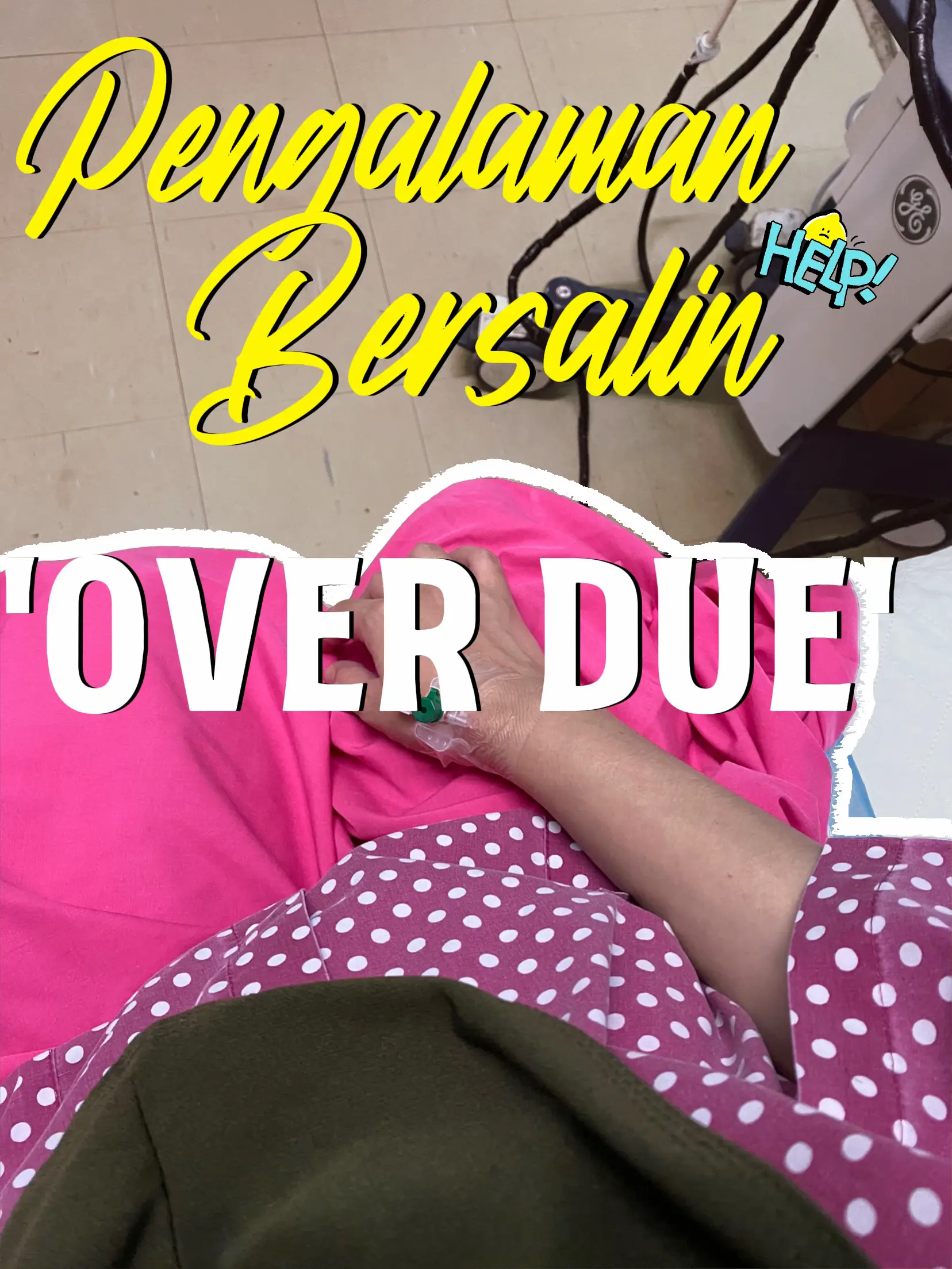 OVER DUE baby | Galeri disiarkan oleh Umi Uzai | Lemon8