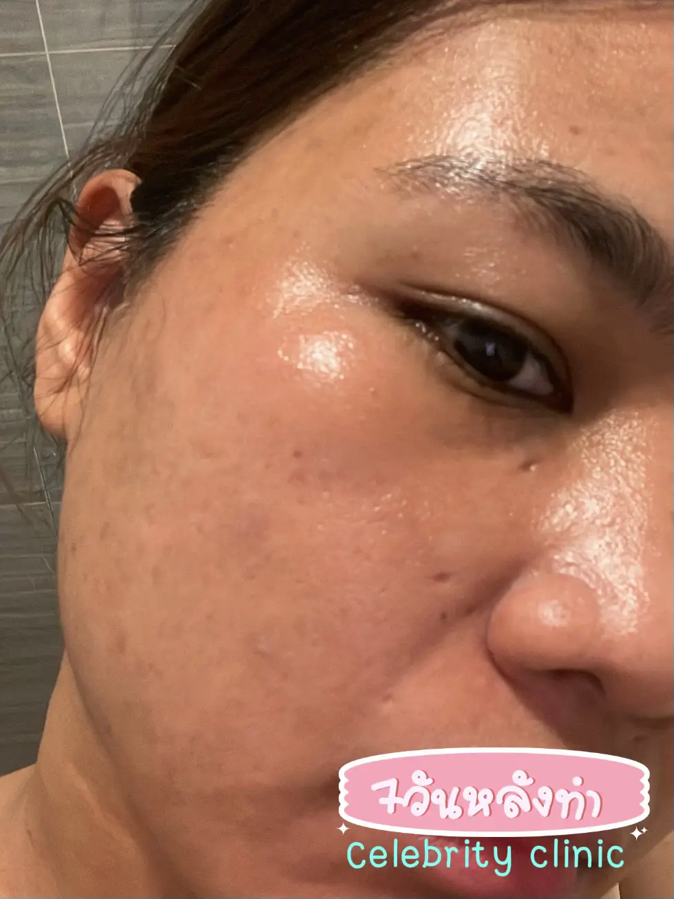 รีวิว Pico 2 ครั้ง | แกลเลอรีที่โพสต์โดย BBBENZKS | Lemon8