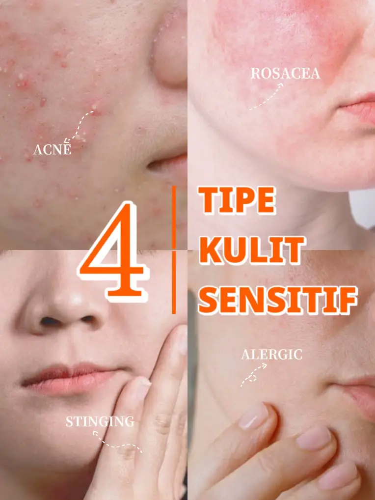 WAJIB TAU ️ PERBEDAAN SENSITIVE SKIN | แกลเลอรีที่โพสต์โดย Susila | Lemon8
