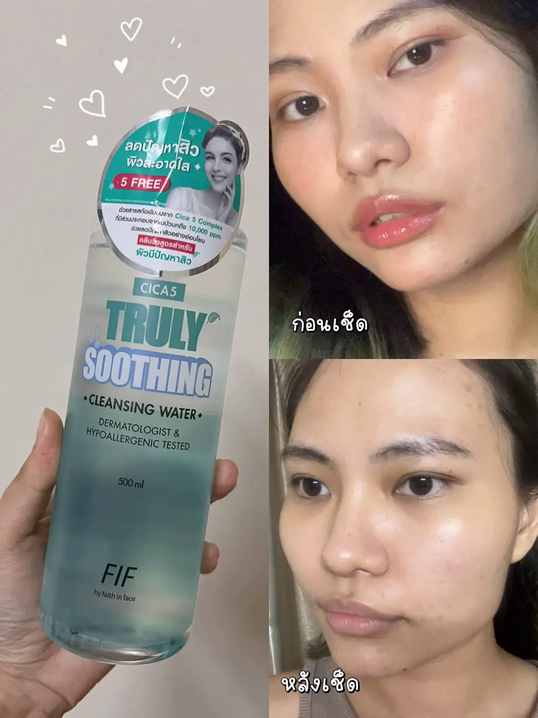 รีวิวคลีนซิ่งสำหรับคนเป็นสิว FIF by Faith in Face ☘️ Cica5 | แกลเลอรี ...