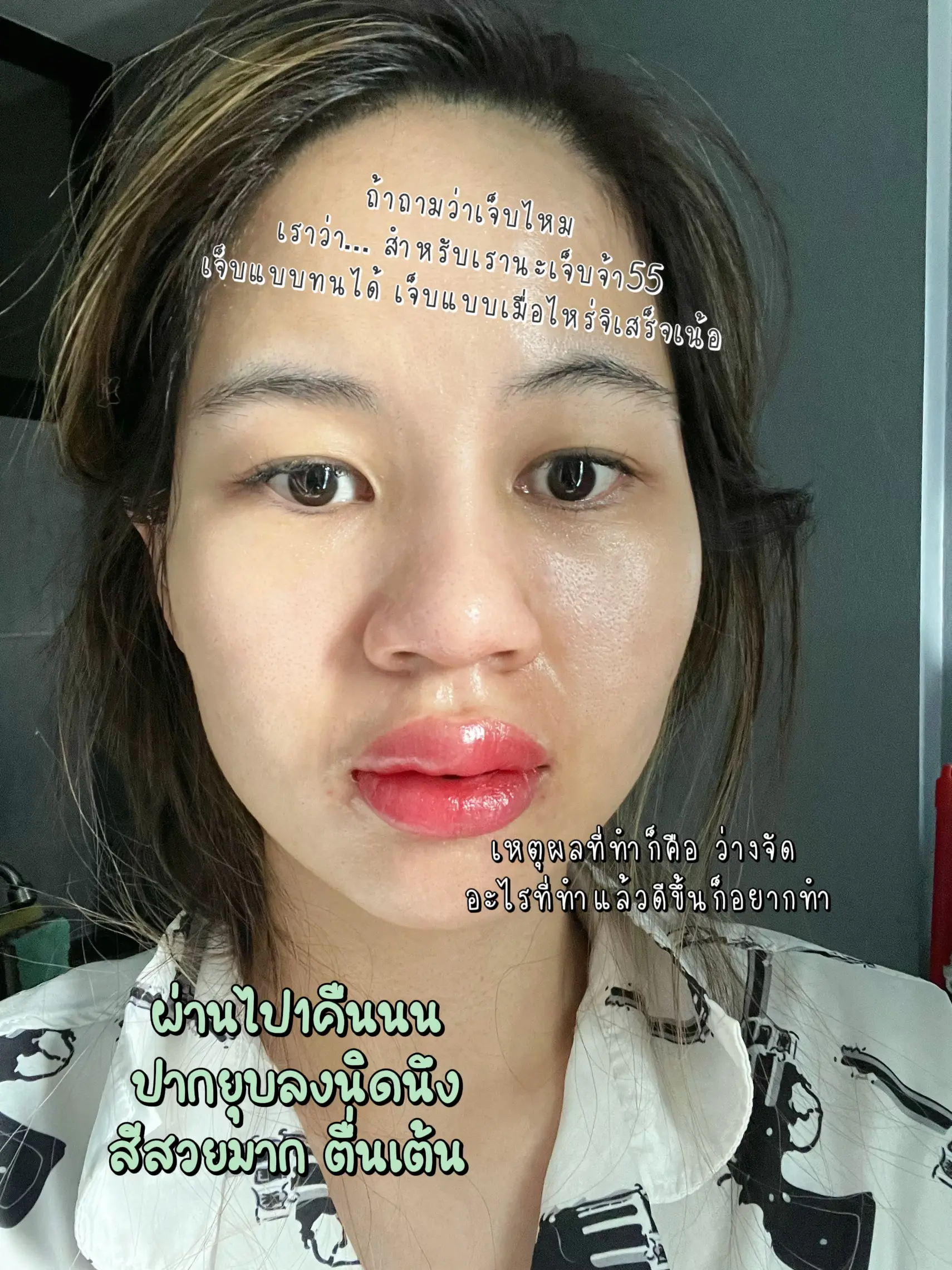 แชร์ประสบการณ์ฝังสีปากจ้า หัวเราะได้นะตามสบาย5555555 🥰 | แกลเลอรีที่โพสต์โดย หมีมาแชร์ | Lemon8