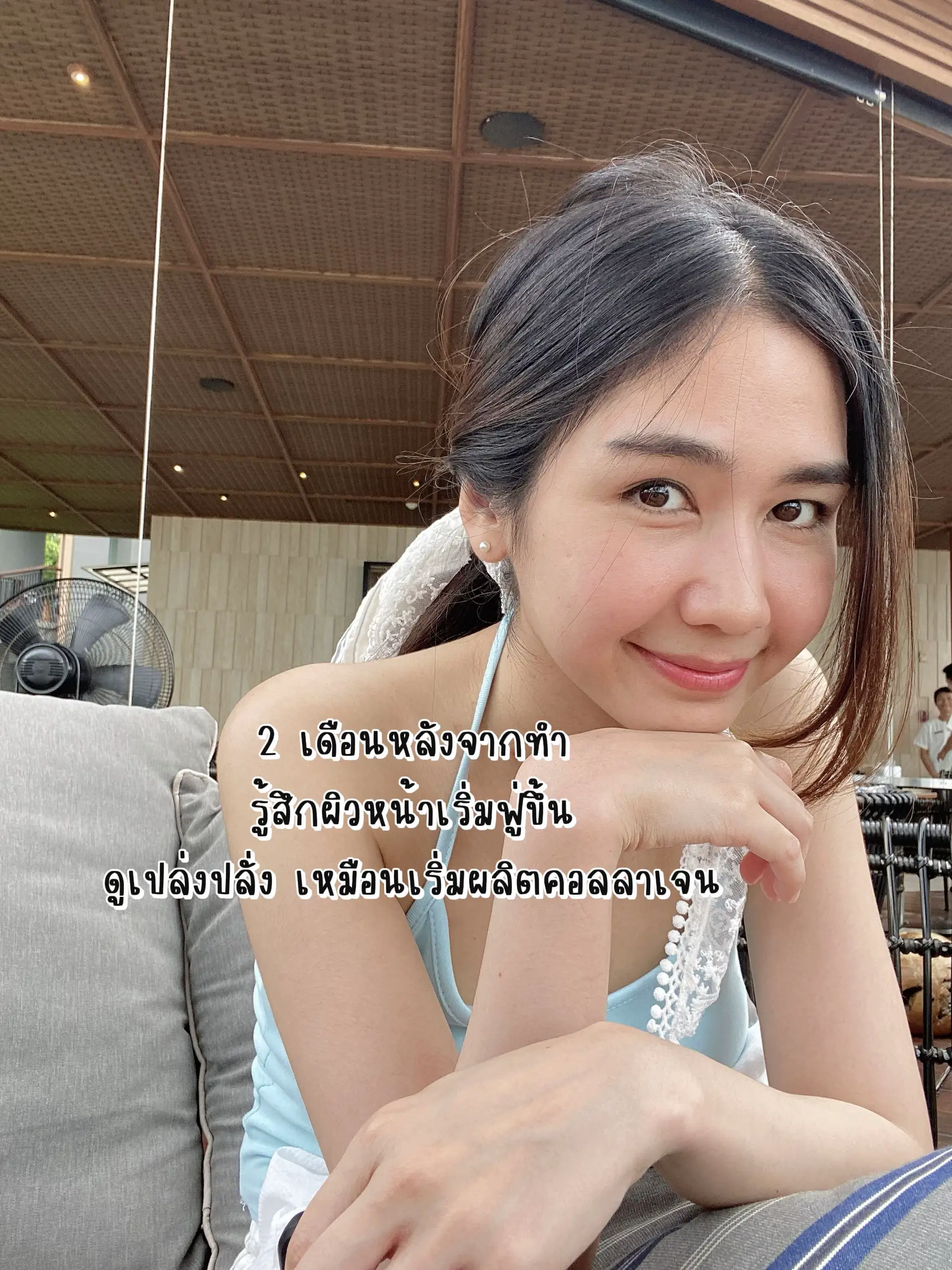 รีวิวหัตถการที่คิดว่าต้องทำซ้ำ 💉 ของคนอายุ 30++ | แกลเลอรีที่โพสต์โดย Fame Mii | Lemon8