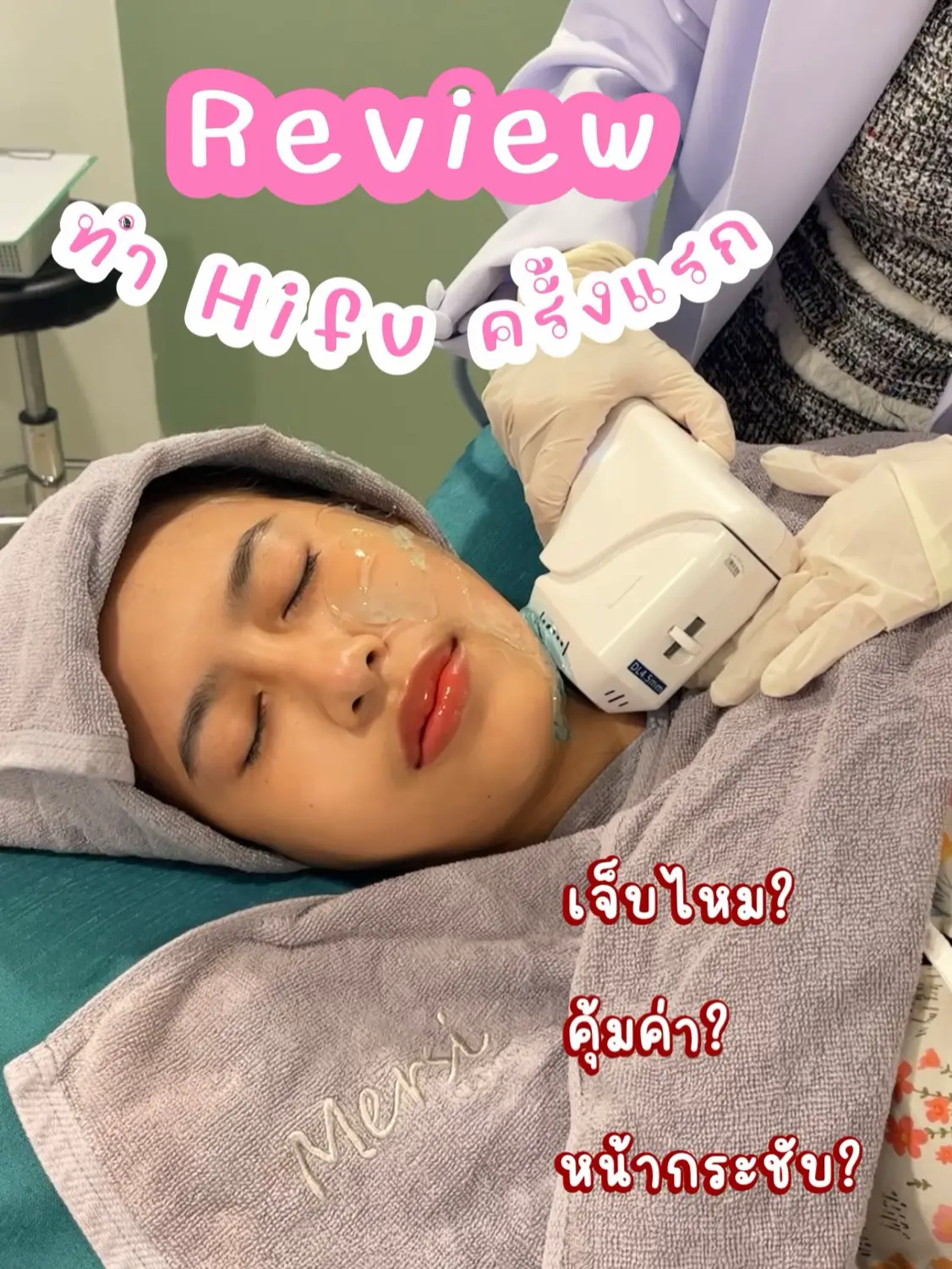 รีวิว การทำ Hifu ครั้งแรก! เห็นผลจริงไหม? | แกลเลอรีที่โพสต์โดย ᴹᴼᴼᴷˢᴬᴵ | Lemon8