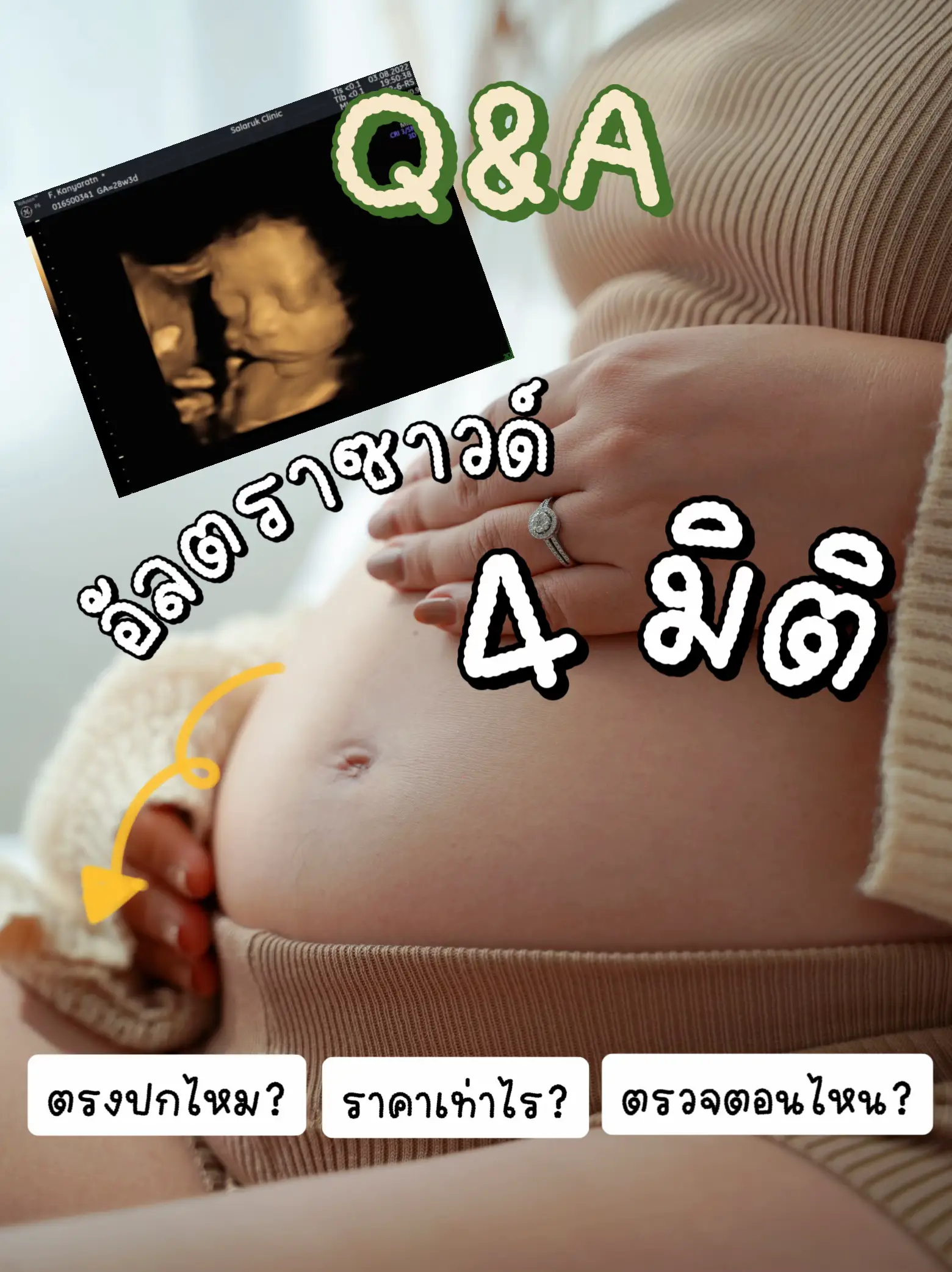 Q&A - 4D Scan ควรทำช่วงไหน ตรงปกไหมนะ? | แกลเลอรีที่โพสต์โดย Stardust 💫 ...