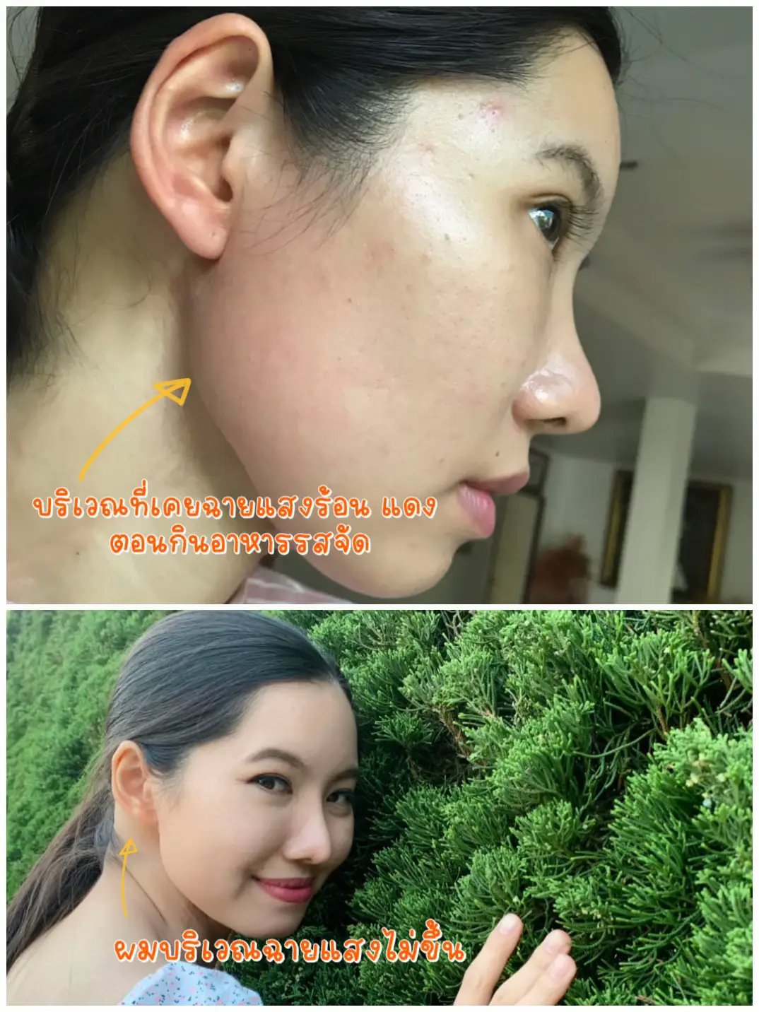 ประสบการณ์เป็นมะเร็งตอนอายุ 24 💪 | แกลเลอรีที่โพสต์โดย khuncha | Lemon8