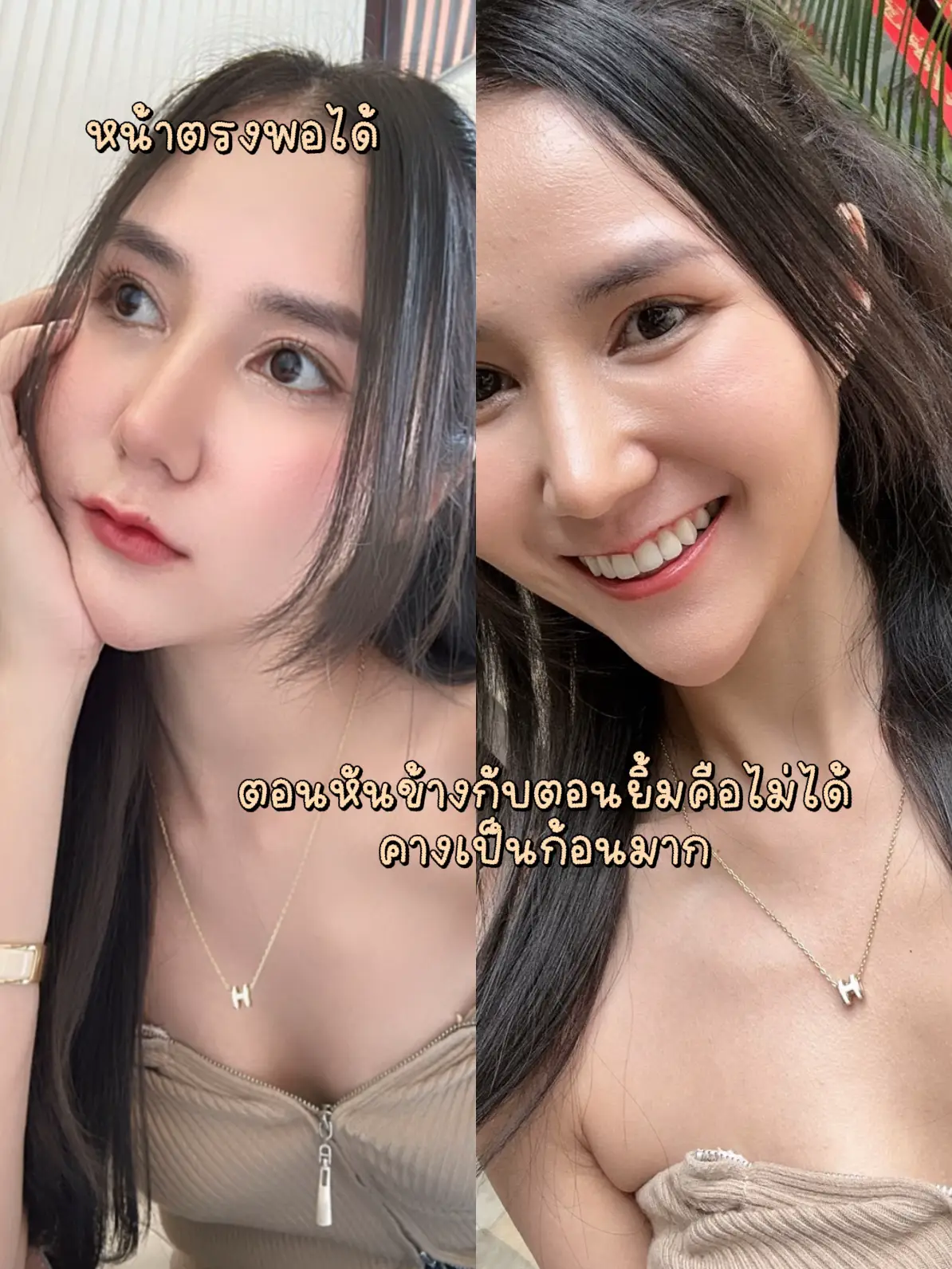 แนะนำาดูก่อนไปฉีดฟิลเลอร์คาง | แกลเลอรีที่โพสต์โดย Donlaya Khotuth | Lemon8