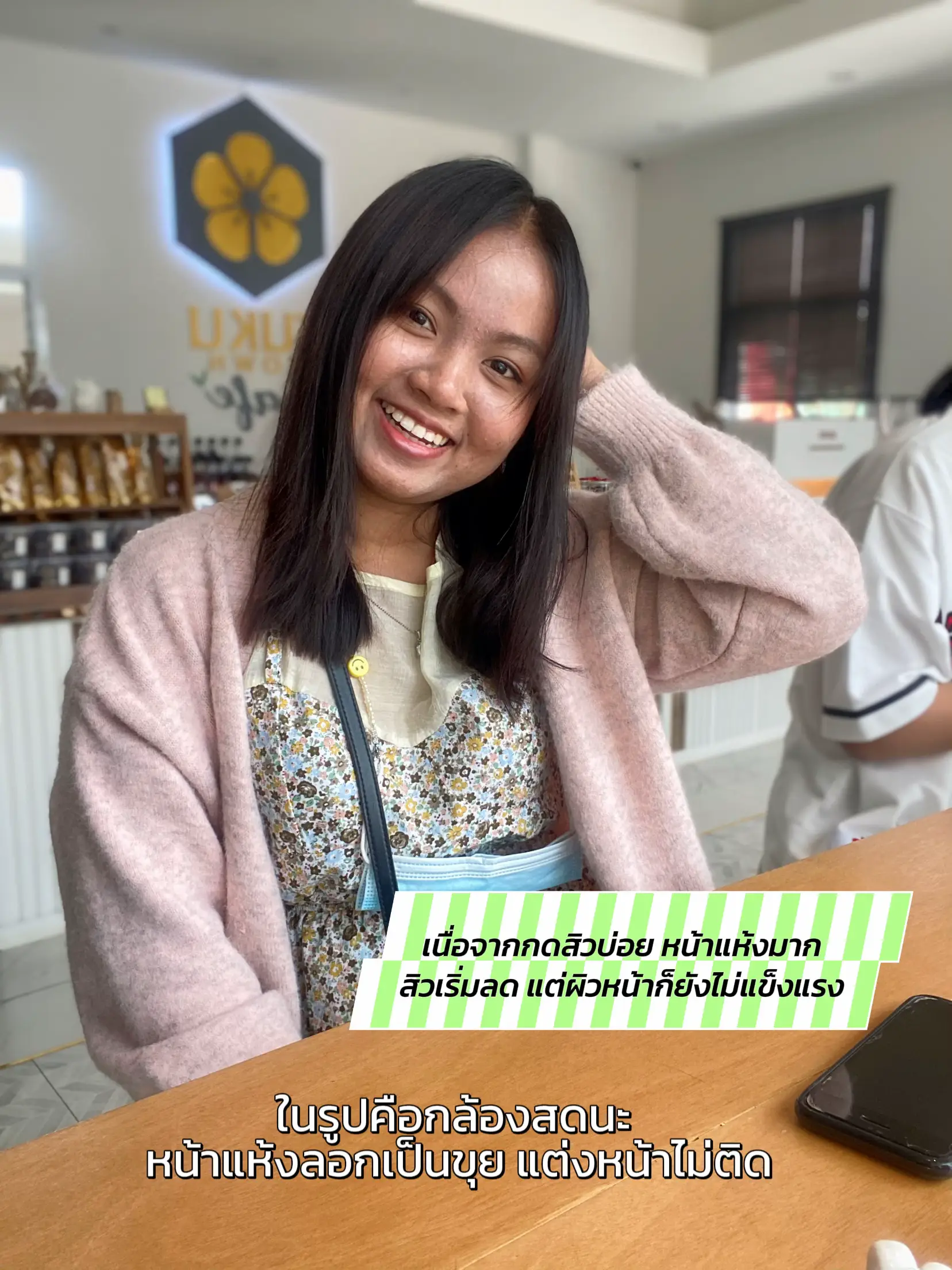 ประสบการณ์รักษาสิวด้วยตัวเอง 🫶🏻 | แกลเลอรีที่โพสต์โดย Tangmo_TM | Lemon8