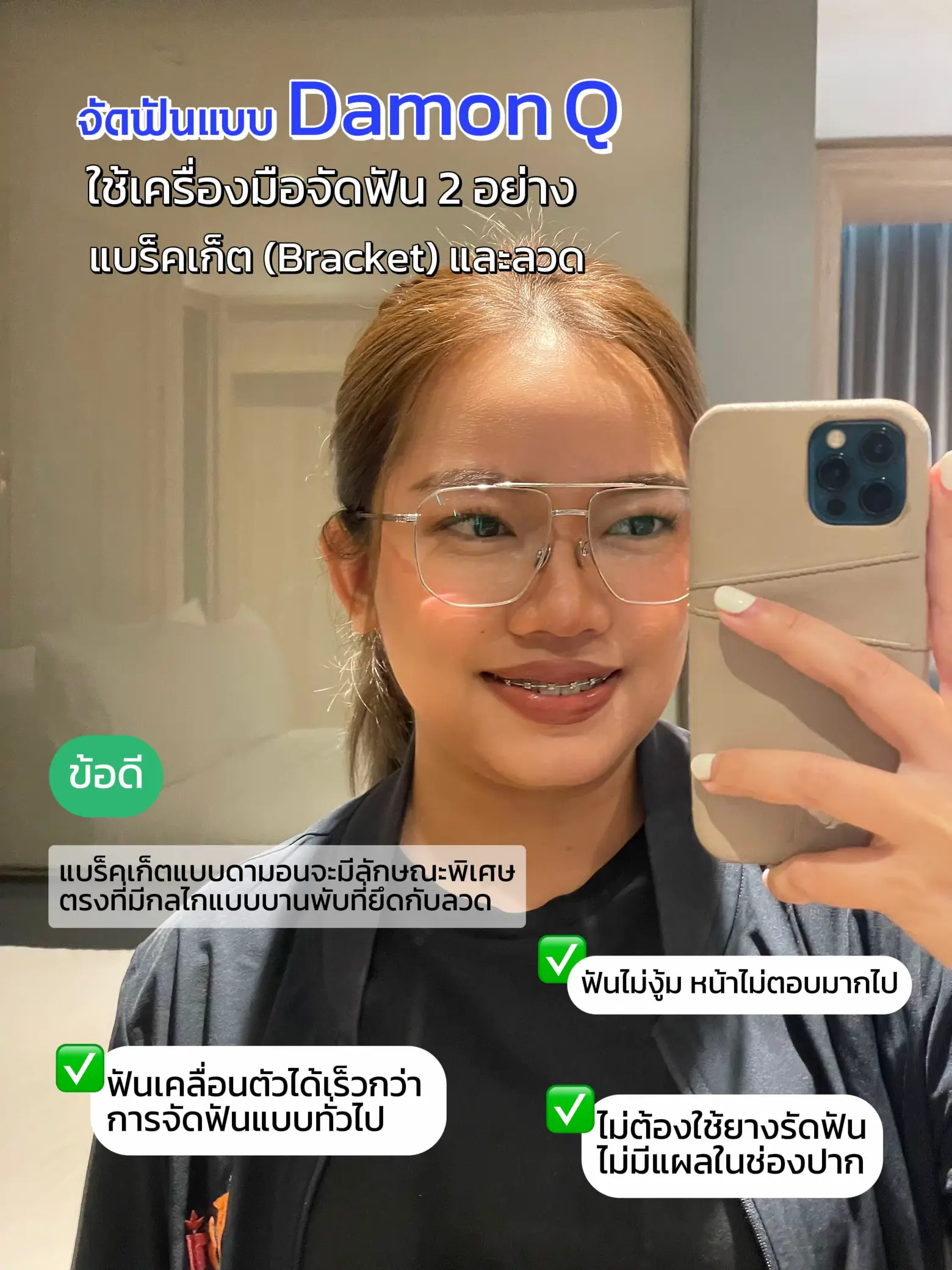 จัดฟันแบบ Damon Q ดีกว่าจัดแบบธรรมดายังไง | แกลเลอรีที่โพสต์โดย NychaNutnicha | Lemon8