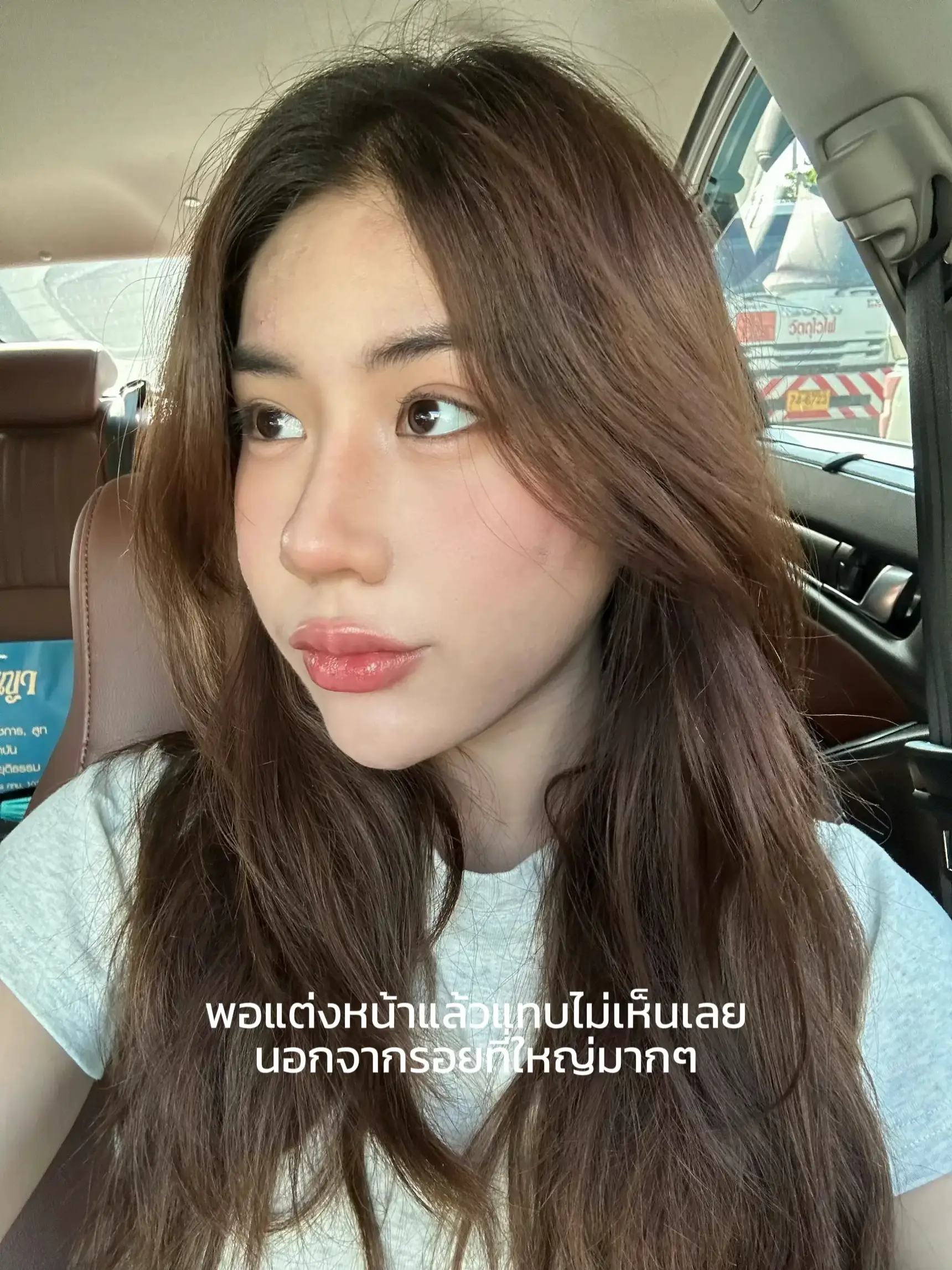 มหากาพย์รักษารอยสิวด้วยตัวเอง! | แกลเลอรีที่โพสต์โดย cherlin.er | Lemon8