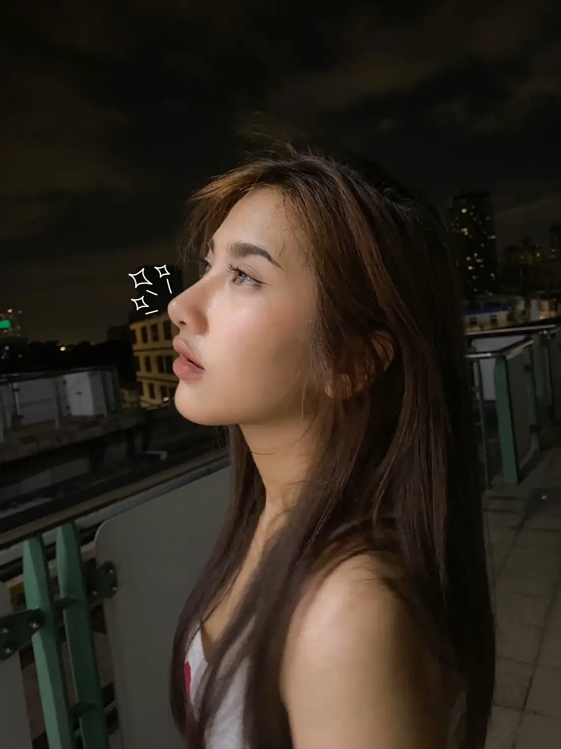 ปังหรือพัง!! ทำจมูกที่ Emma clinic | แกลเลอรีที่โพสต์โดย poi🍒 | Lemon8