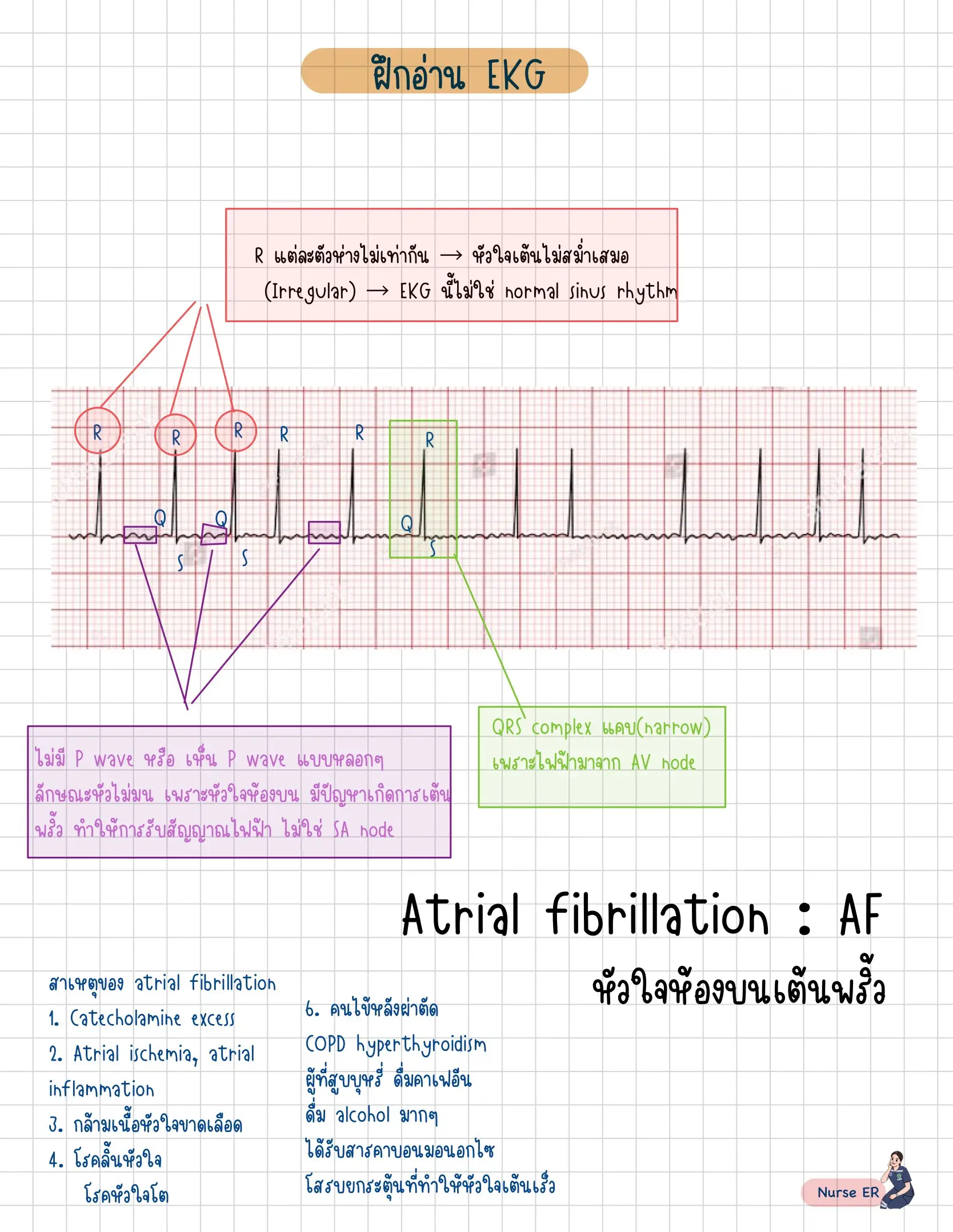 wichudafangmuangk โพสต์ผลงานแล | แกลเลอรีที่โพสต์โดย Nurse ER | Lemon8