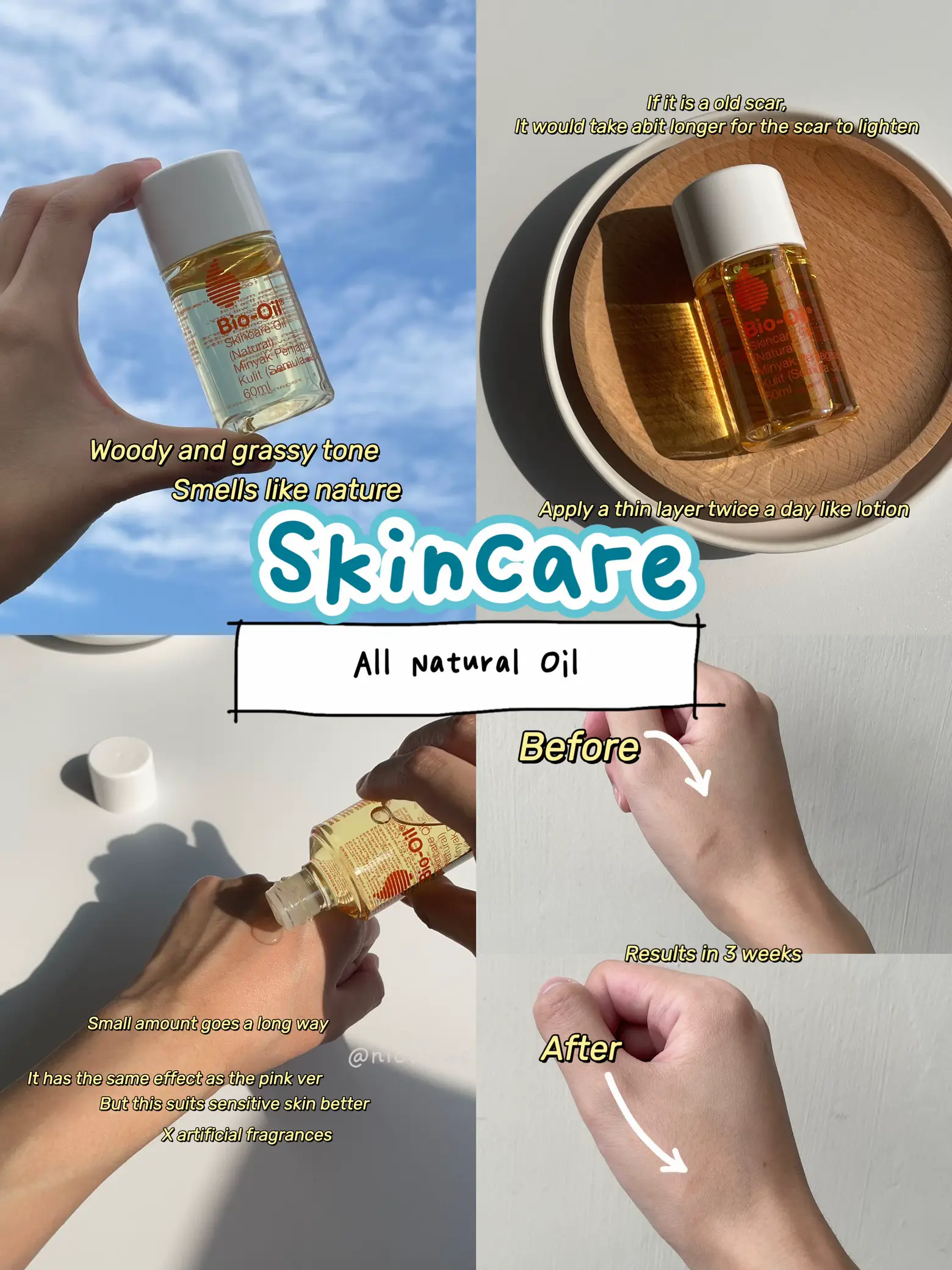 How to remove scars | Galeri disiarkan oleh Nicole | Lemon8