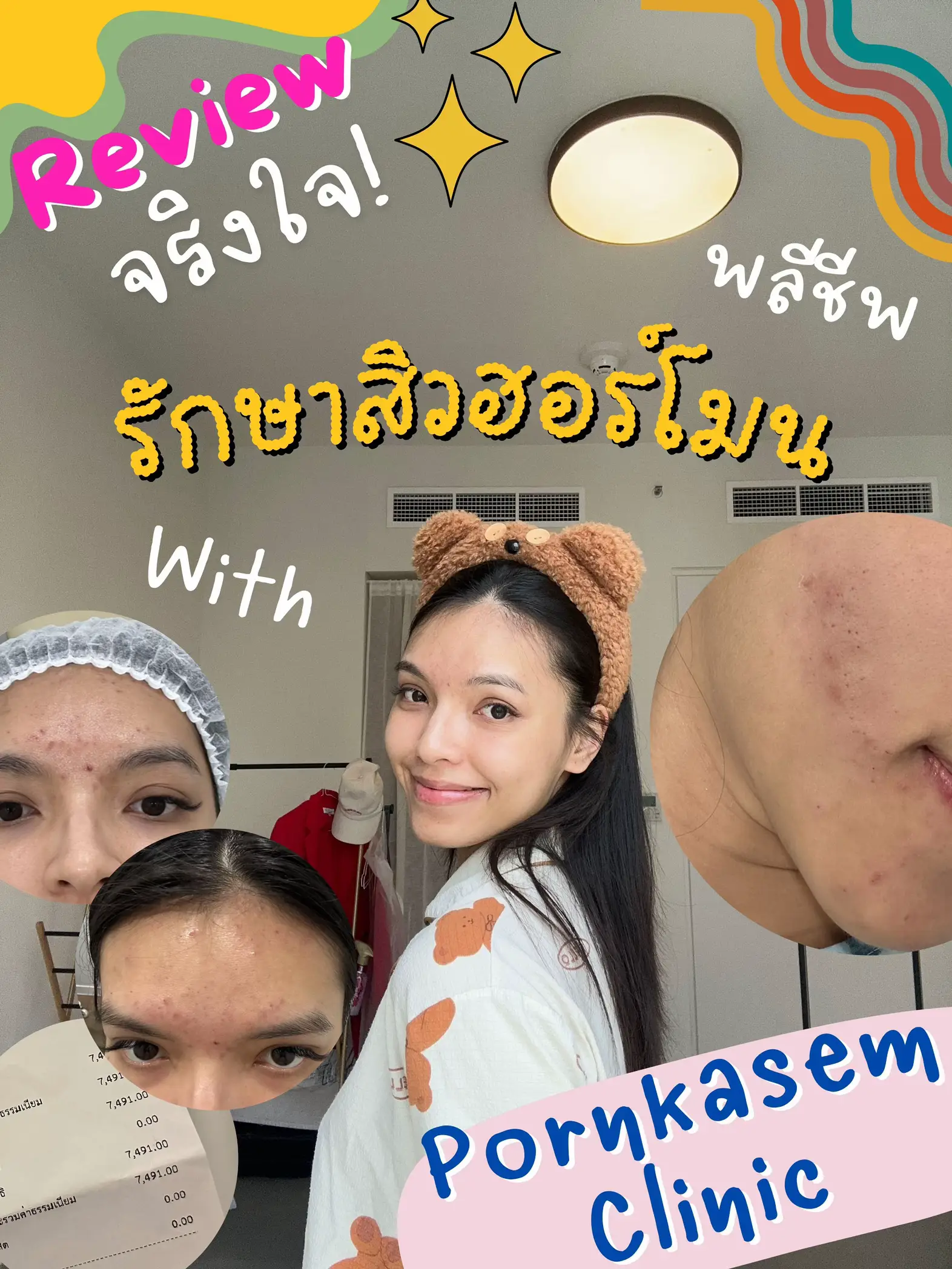 🍋รักษารอยสิวด้วย ADVA Light Program กับ พรเกษมคลินิก | วิดีโอที่เผยแพร่โดย 🧚Jenjira 246💃 | Lemon8