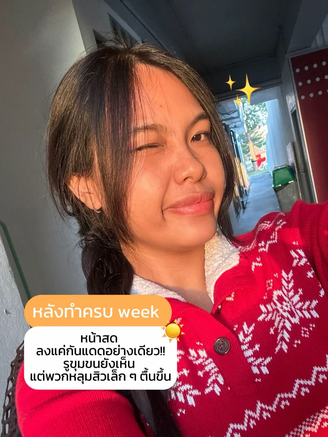 Pico หน้าแดง 2 ใบเทา ช่วยอะไรบ้าง!? | แกลเลอรีที่โพสต์โดย พัดลม | Lemon8