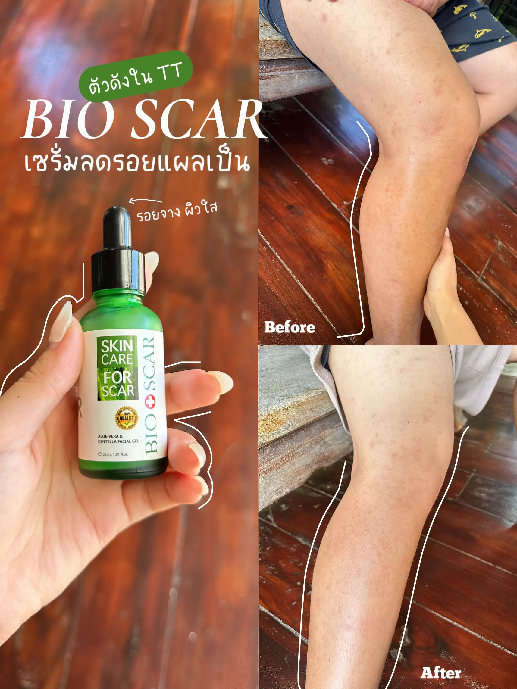 BIO SCAR 🍃เซรั่มลดรอยแผลเป็นตัวดัง ต๊อกๆ 🔥 | แกลเลอรีที่โพสต์โดย ...