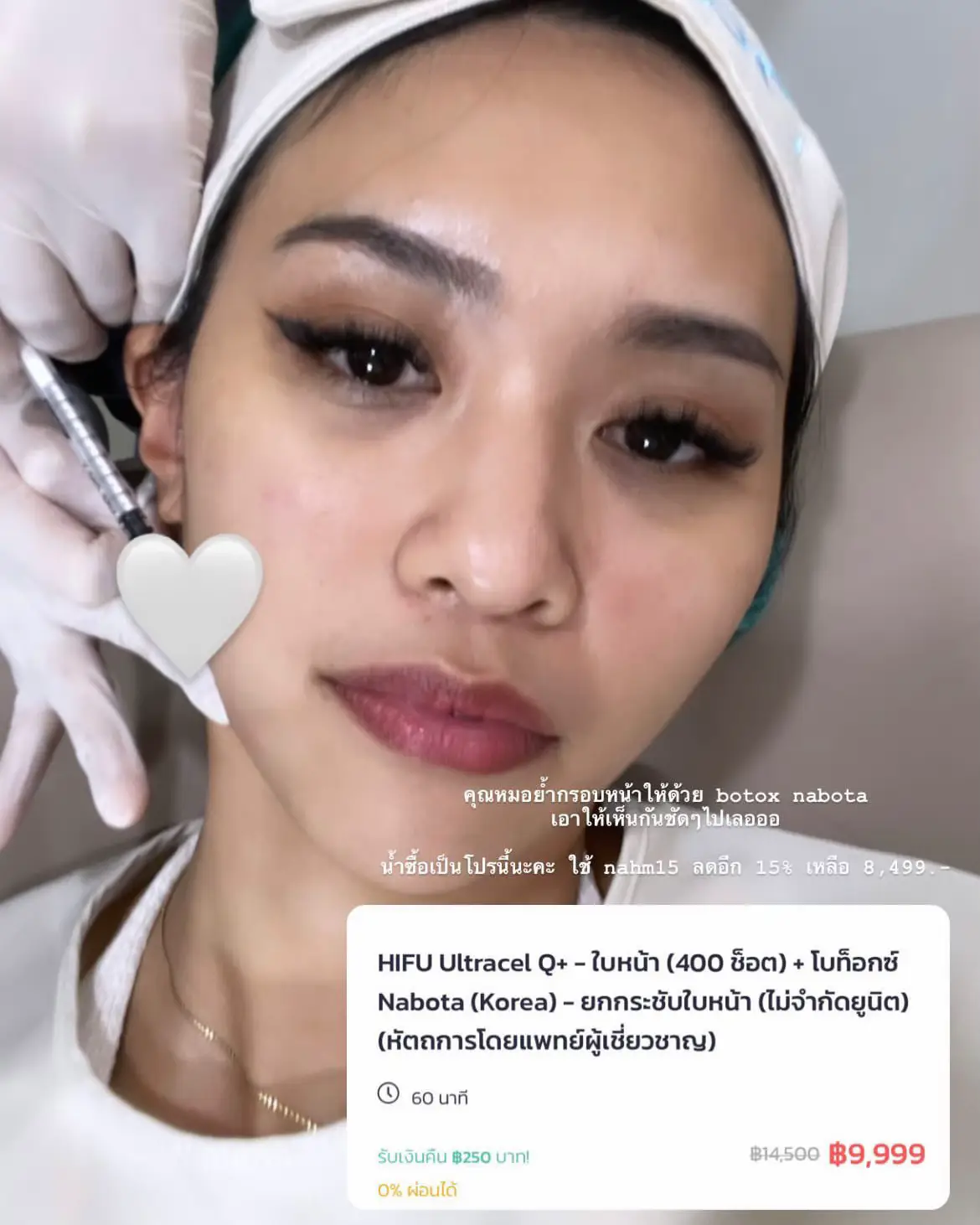 รีวิวหัตถการที่ชอบที่สุดในปีนี้ Linear HIFU by Ultracel Q+ 💗 | แกลเลอรีที่โพสต์โดย Nahmner | Lemon8