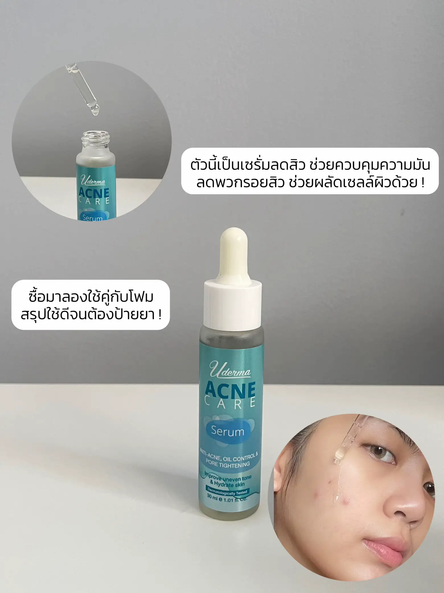 Skincare routine ฉบับผิวเป็นสิว แพ้ง่าย 🦠💡 | แกลเลอรีที่โพสต์โดย Kkacha | Lemon8