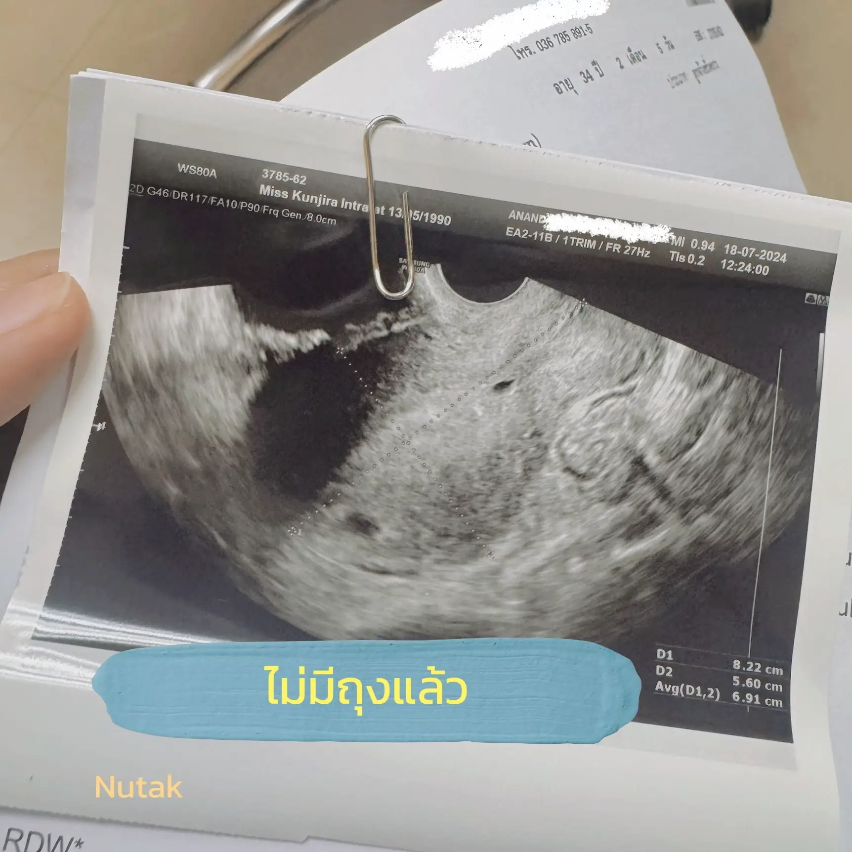 ประสบการณ์ที่ไม่อยากให้เกิด 😥 | แกลเลอรีที่โพสต์โดย NuTaK :D 😊 | Lemon8