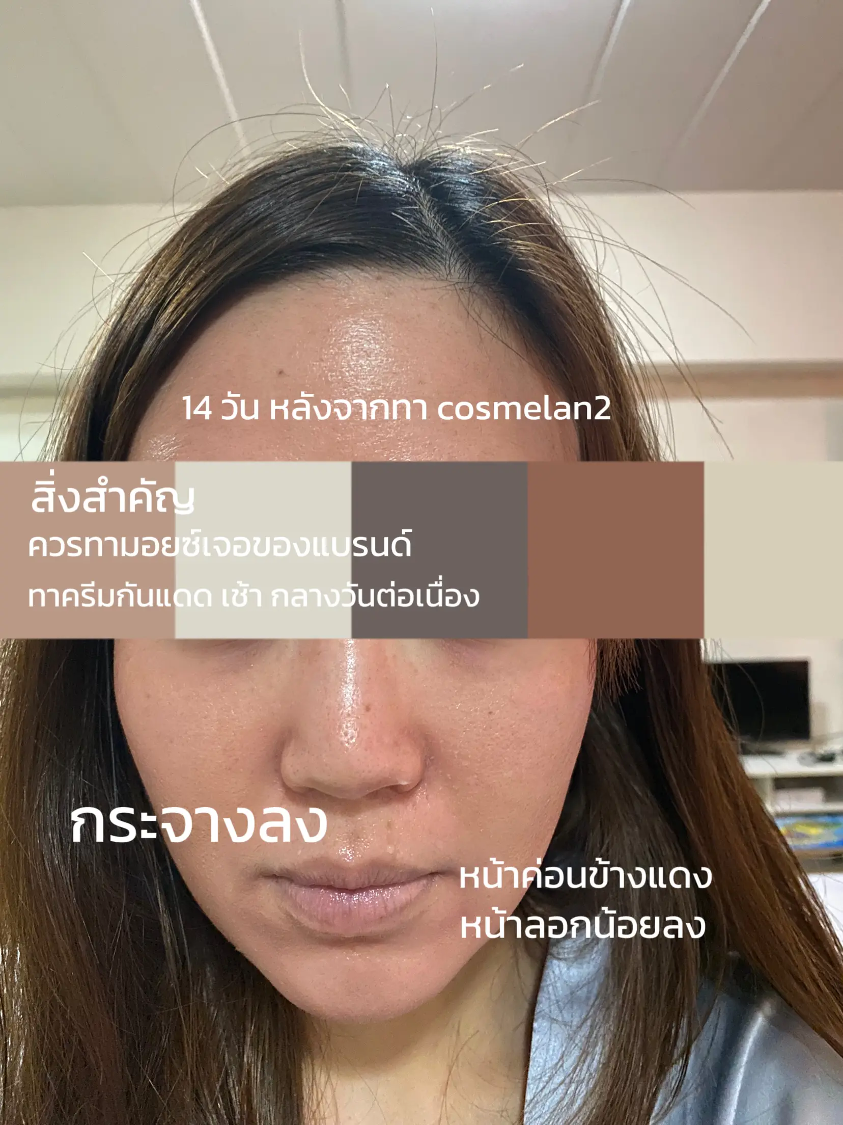 Review พลีชีพ ครีมรักษากระ cosmelan2 | แกลเลอรีที่โพสต์โดย Pupoo Prey | Lemon8