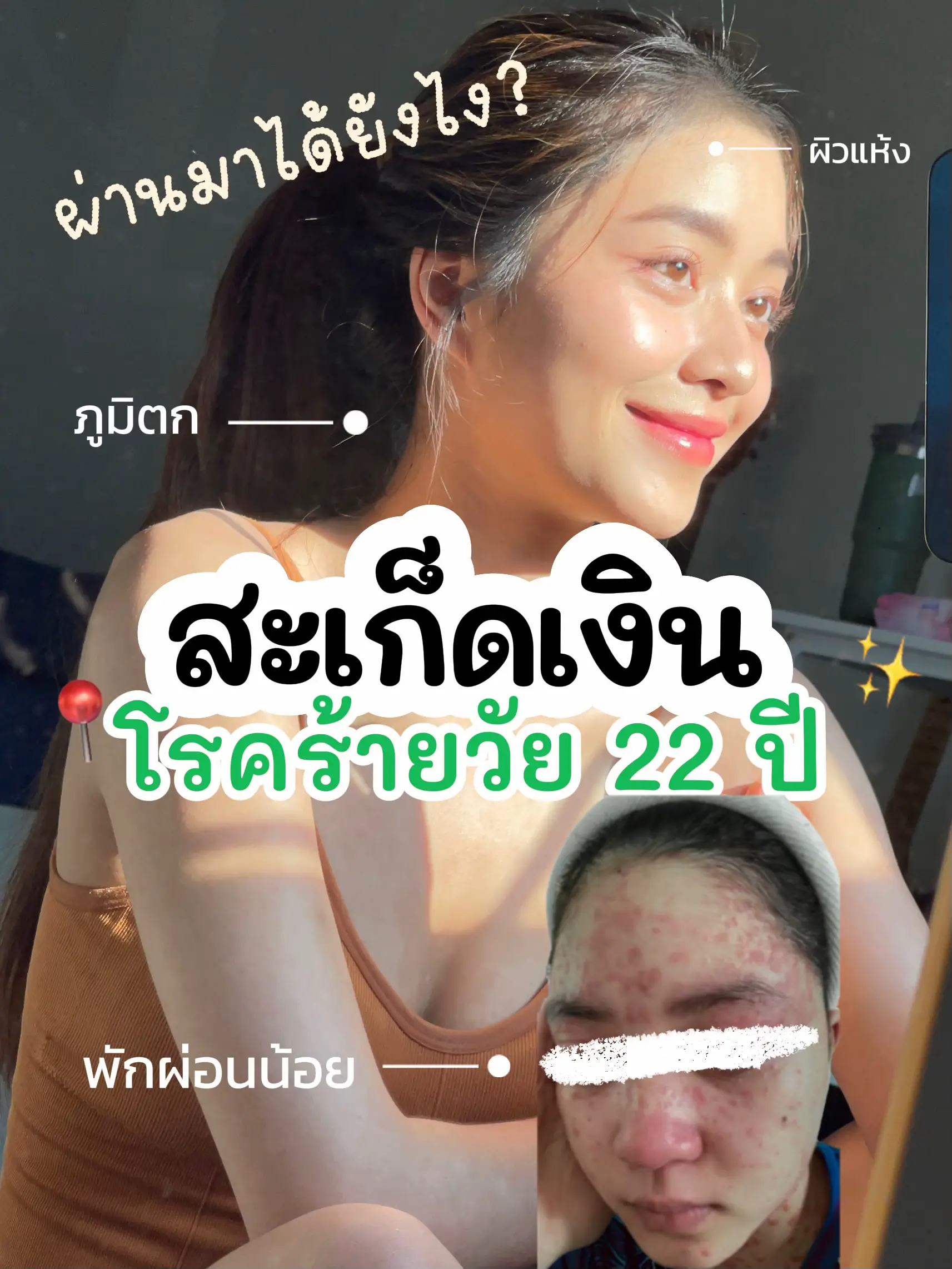 เป็นกำลังใจให้พี่ตูนนะคะ🫶🏻💓 | แกลเลอรีที่โพสต์โดย Naoko ♡ | Lemon8