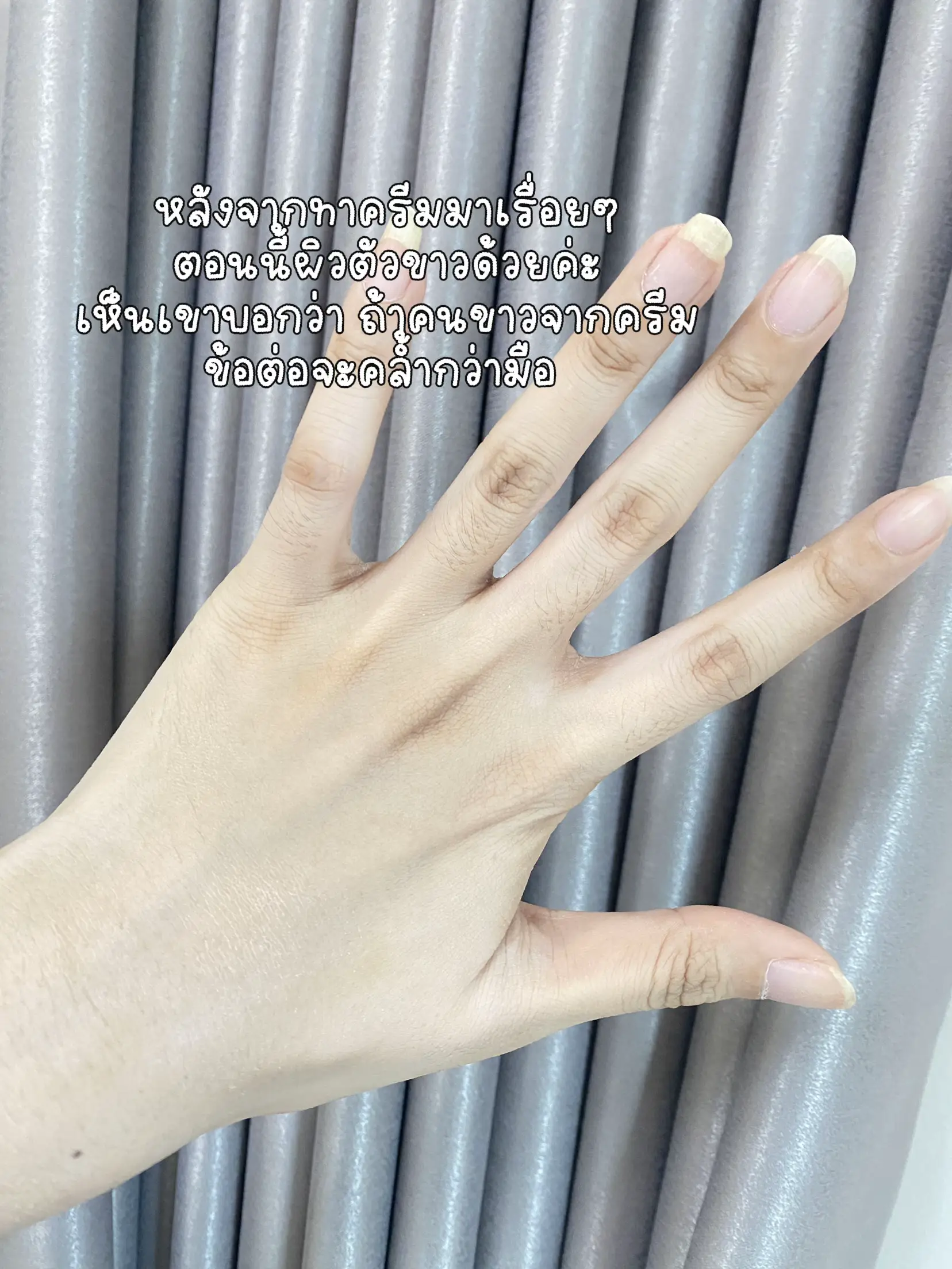 ไม่คิดว่าจะเจอวิธีที่ทำให้ศอกหายดำได้! | แกลเลอรีที่โพสต์โดย aomchuti | Lemon8