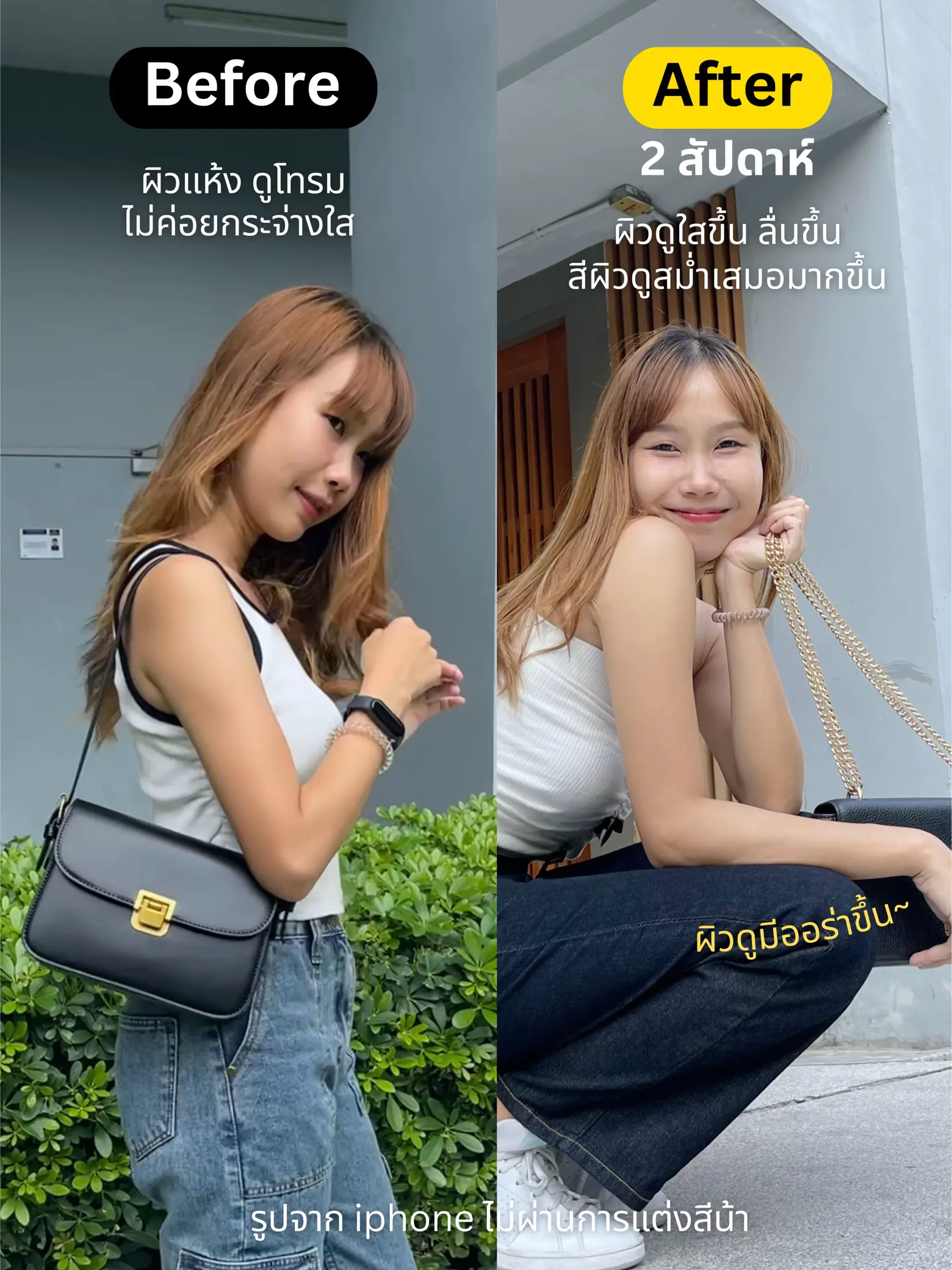 ป้ายยา วิตามินเซเว่น 2 คู่หูผิวใส กินคู่กัน ผิวปังมากแม่ | แกลเลอรีที่โพสต์โดย Pearrie bob ツ ...