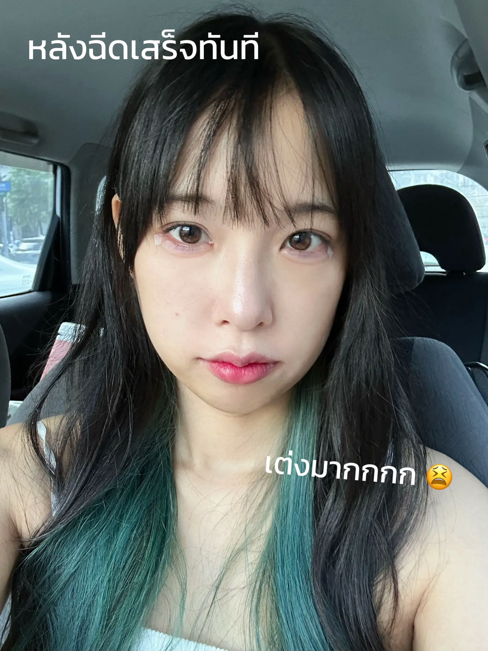 คิดถูก คิดผิดเนี่ย ที่ฉีดดอลลี่อาย 😫⁉️ | แกลเลอรีที่โพสต์โดย Hello muse 🪄 | Lemon8