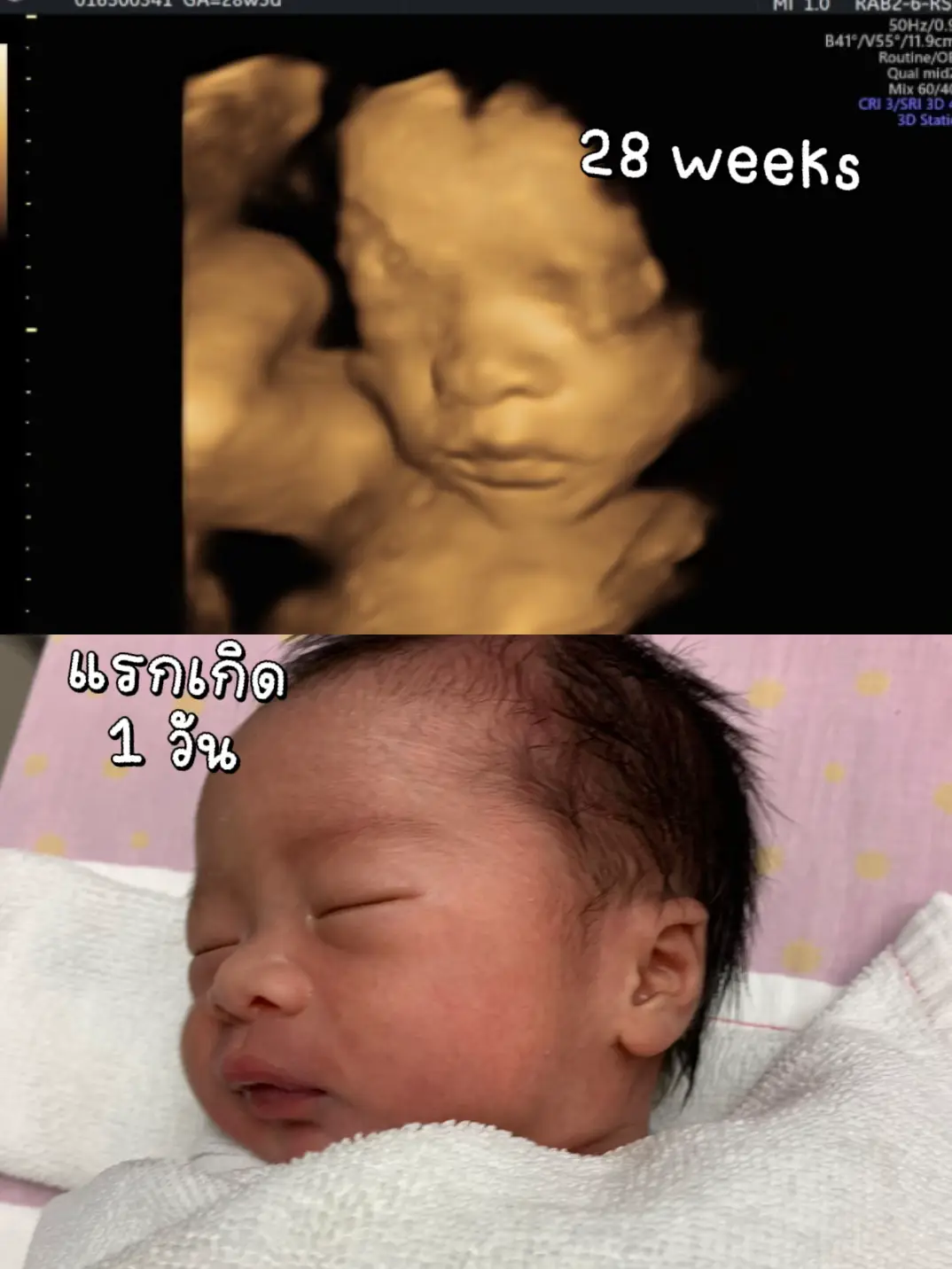 Q&A - 4D Scan ควรทำช่วงไหน ตรงปกไหมนะ? | แกลเลอรีที่โพสต์โดย Stardust 💫 ...