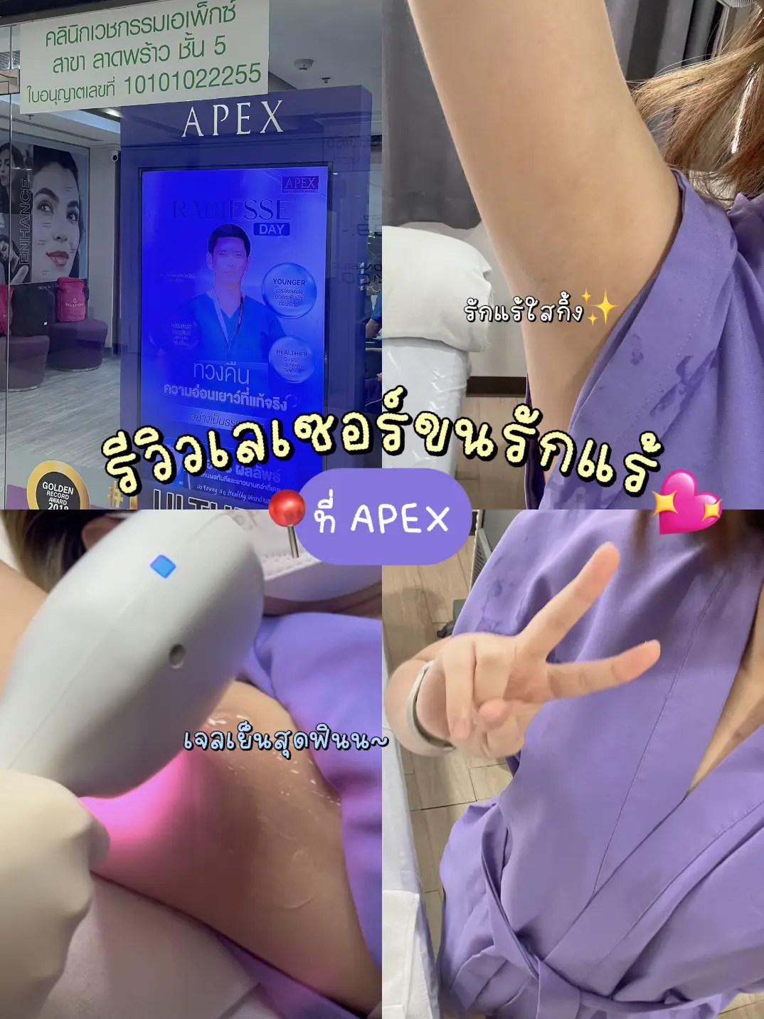 รีวิวเลเซอร์ขนรักแร้ที่ APEX💜⭐️ | แกลเลอรีที่โพสต์โดย Earn.jrp⭐️ | Lemon8