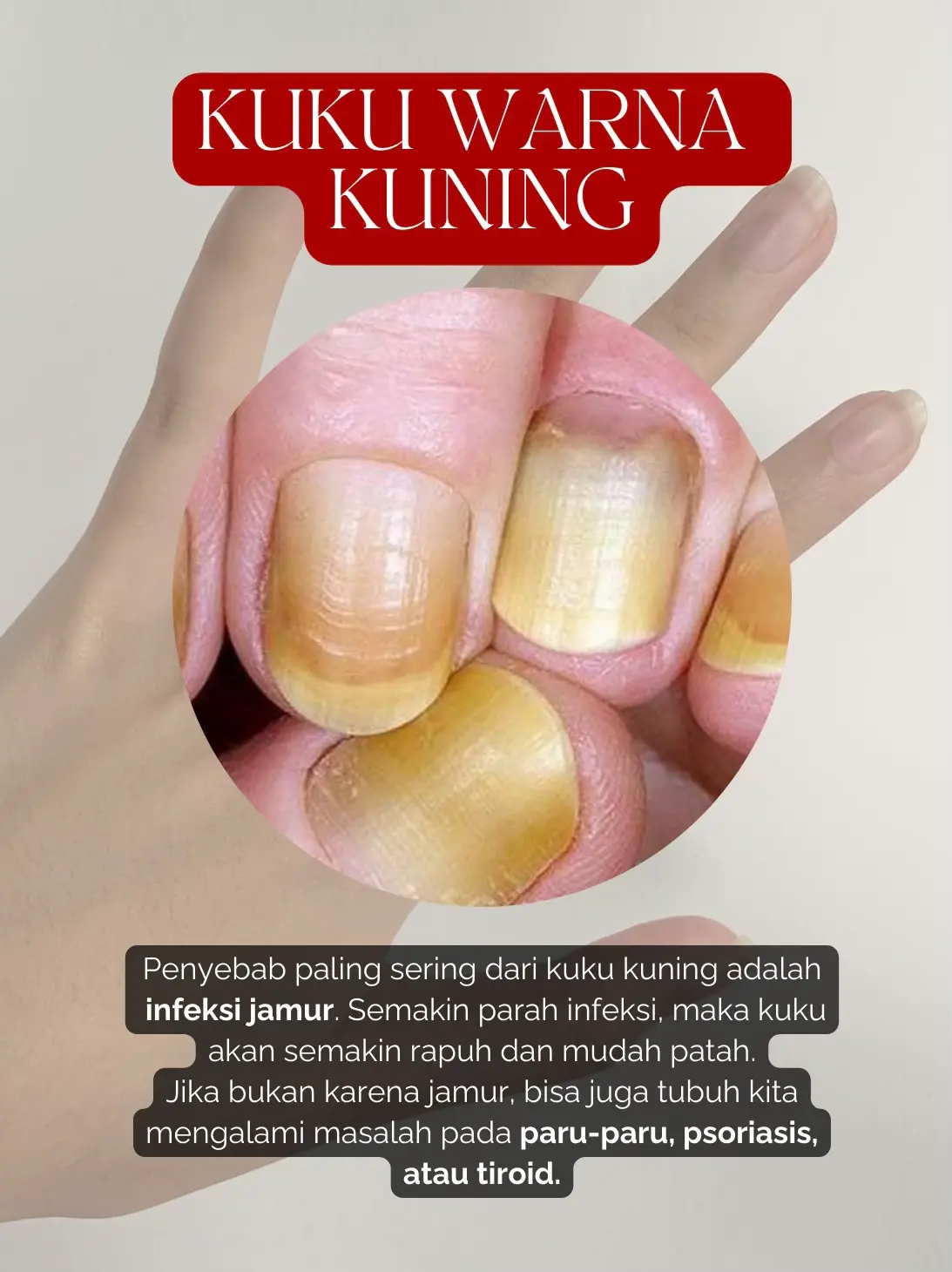WARNA KUKU TUNJUKKAN KONDISI KESEHATANMU!⚠️😱 | Galeri diposting oleh Charmine🤍 | Lemon8