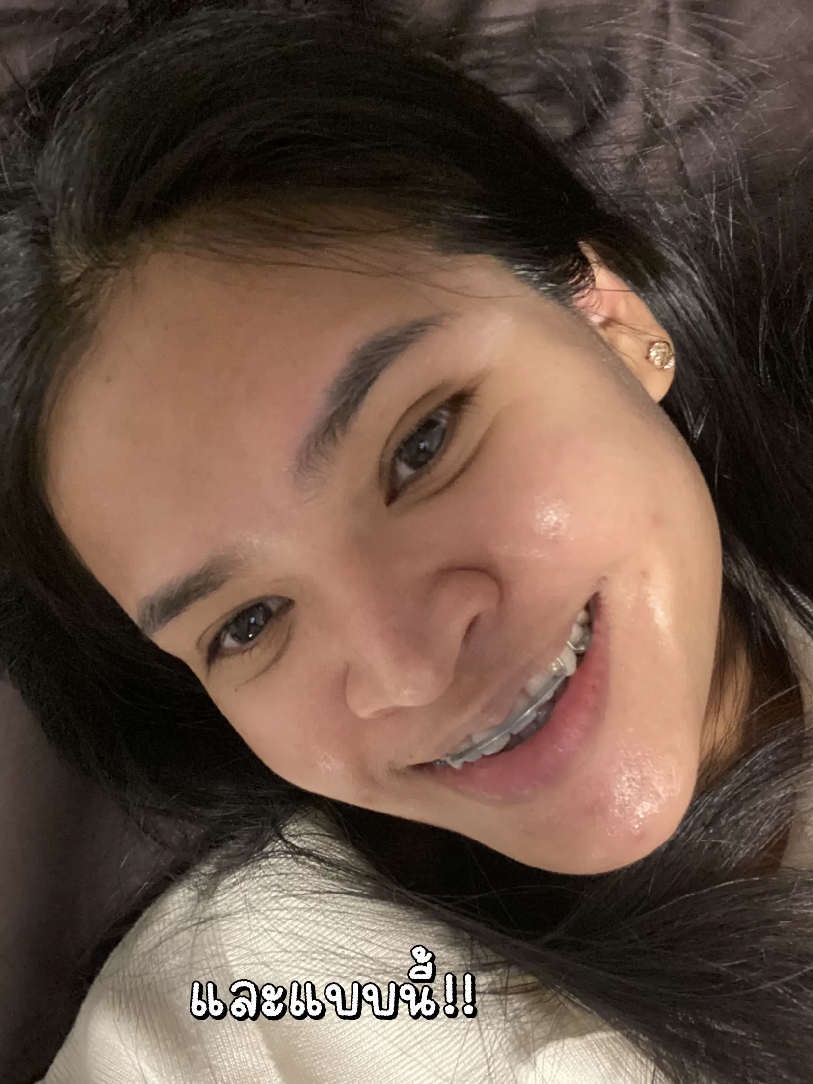 อย่าหาใช้ เรตินอล+มอยเจอร์ไรเซอร์ ถ้าไม่อยากเป็นแบบนี่ | แกลเลอรีที่โพสต์โดย Aomsin Thanapha ...