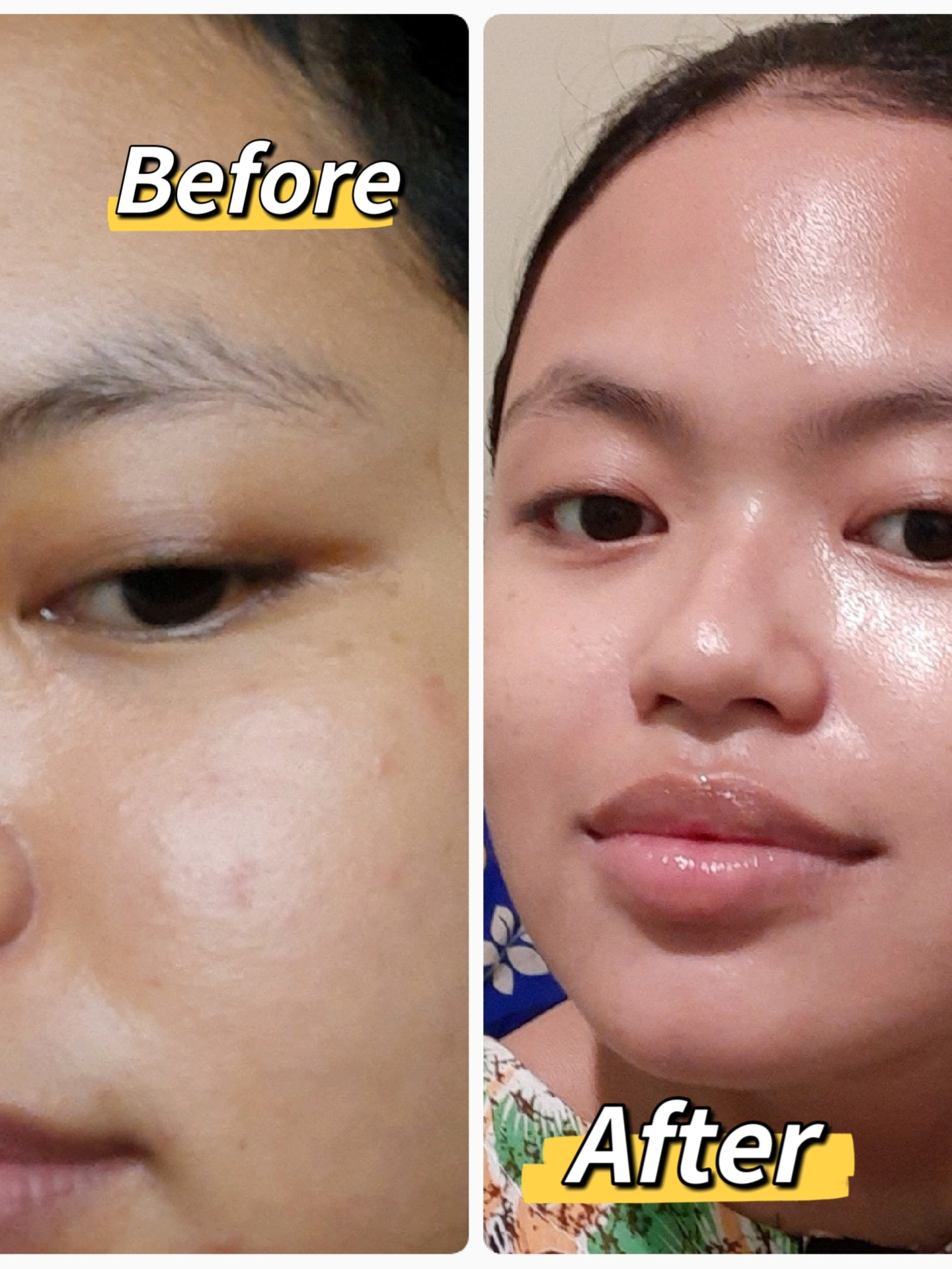 Dampak Skin Cycling | Video dipublikasikan oleh Sabil armain | Lemon8