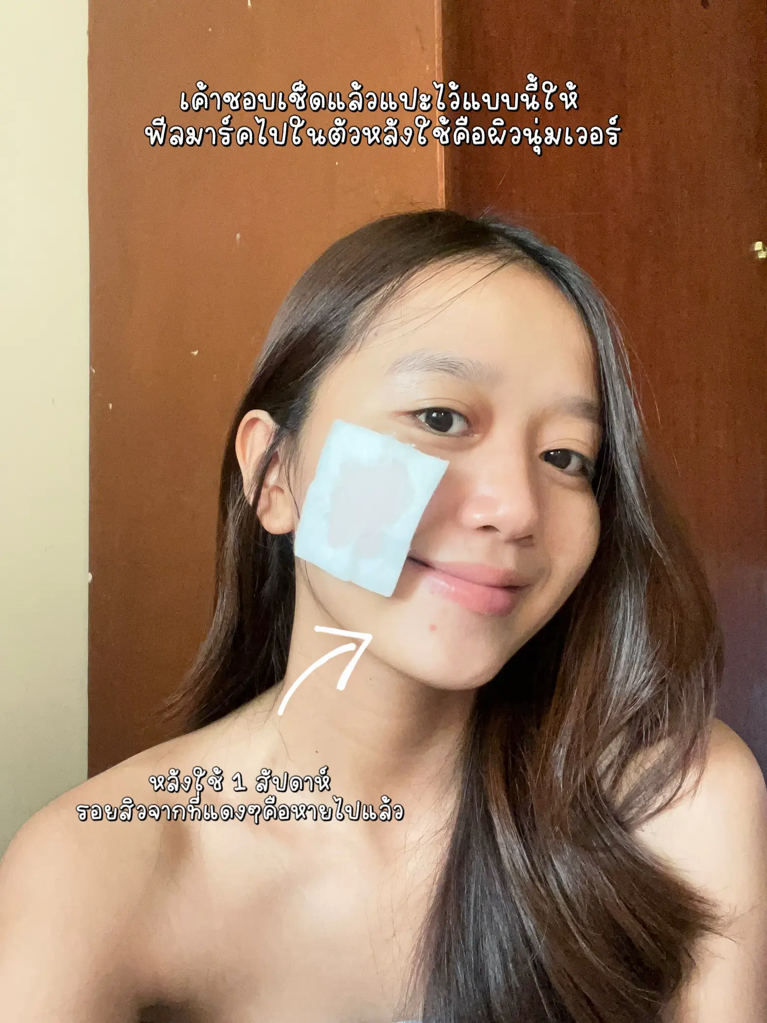 โทนเนอร์ฉบับคนเป็นสิว ต้องลอง 🫶🏻👀 | แกลเลอรีที่โพสต์โดย nisc.h | Lemon8