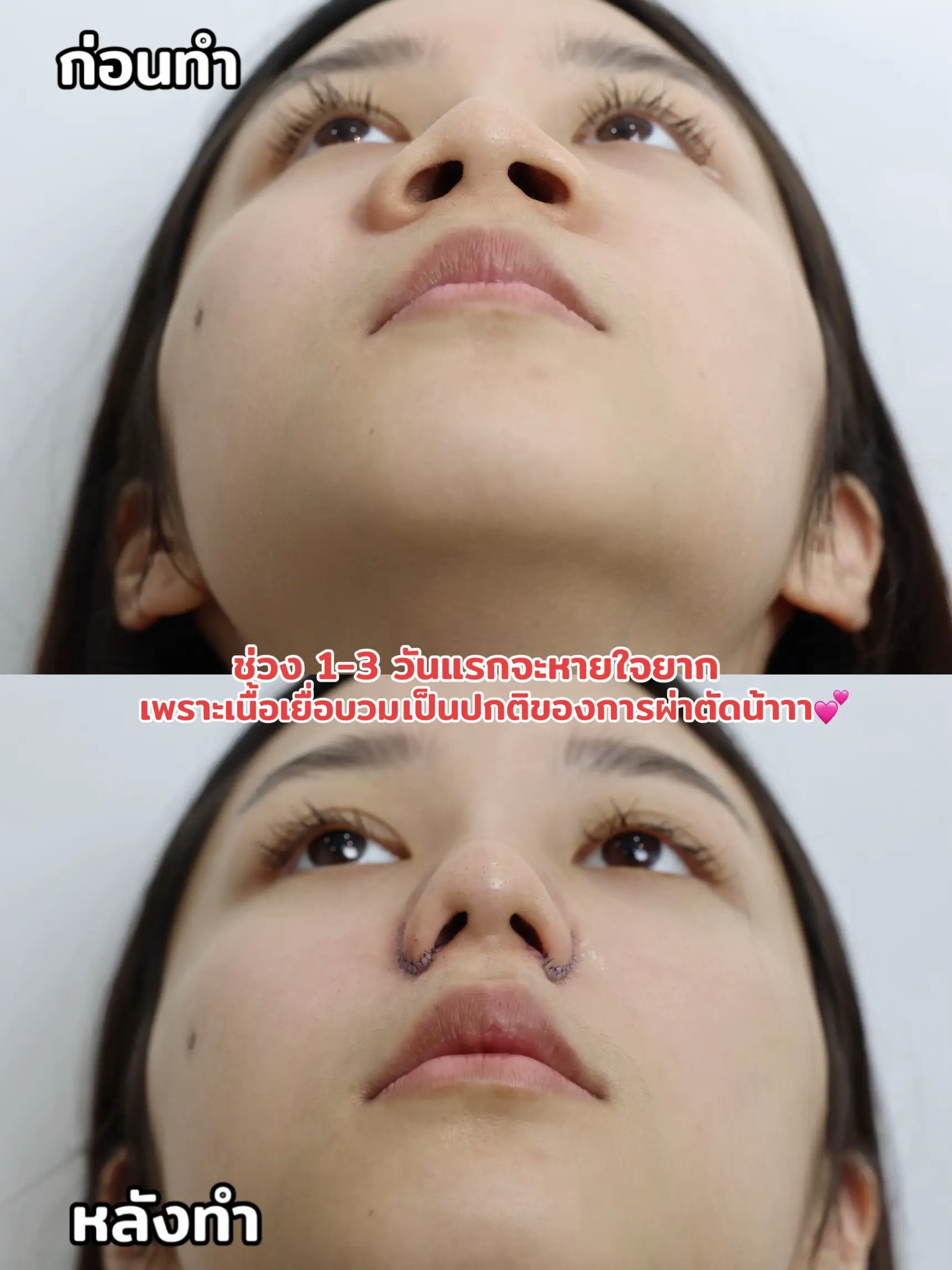 จมูกหันข้างใบเฟ - การค้นหาใน Lemon8