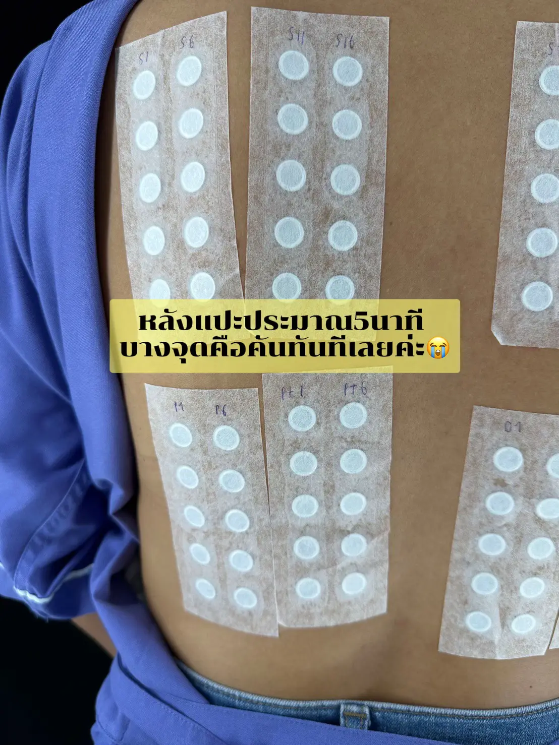 Patch test กับคนแพ้ลิปสติกแบบเรา | แกลเลอรีที่โพสต์โดย แอปปาเลิ่น | Lemon8