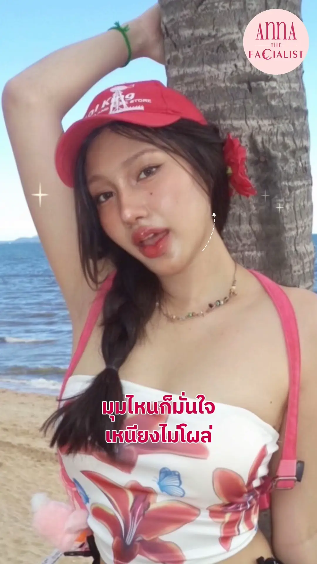 Triple Fat | วิดีโอที่เผยแพร่โดย annaclinic | Lemon8