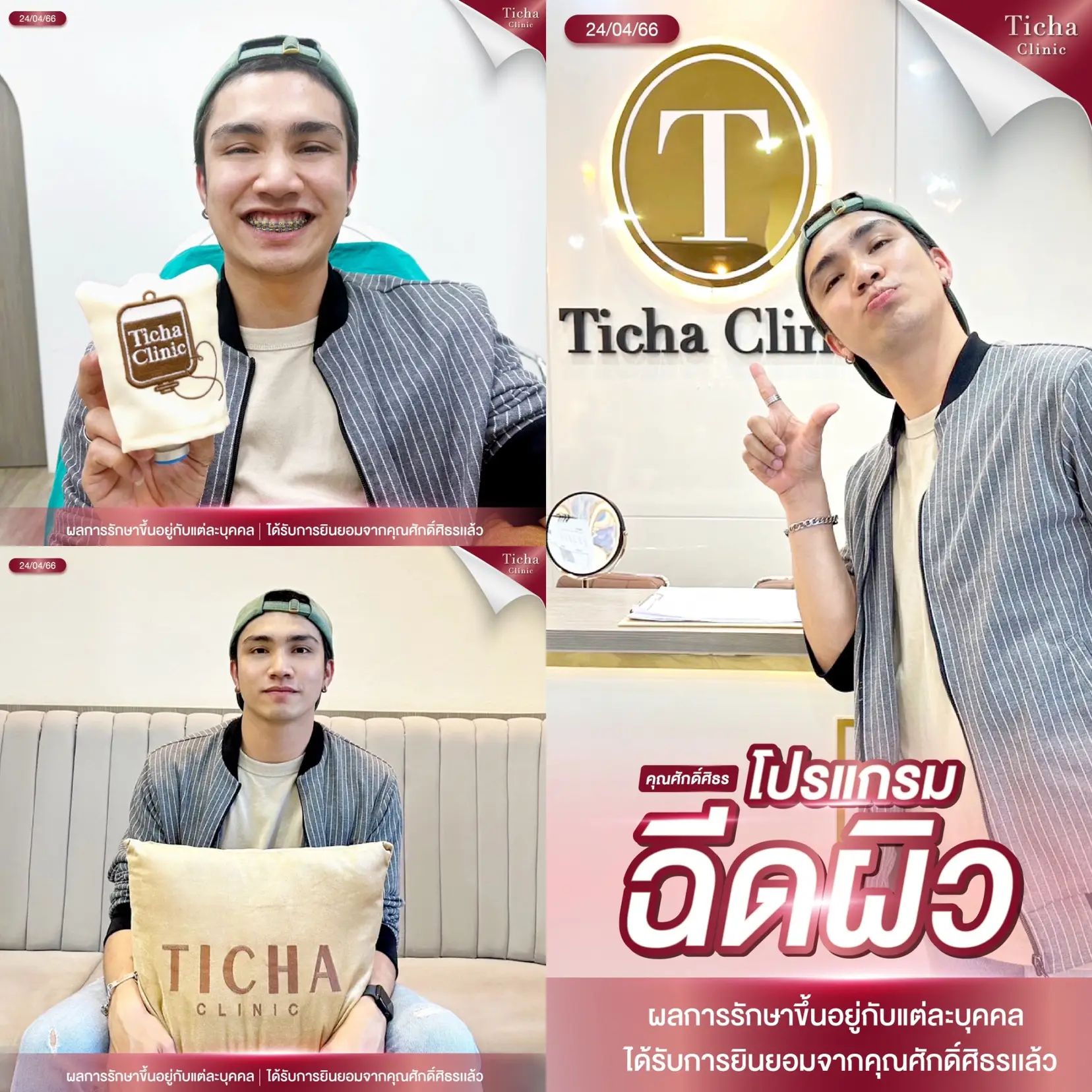 ผู้ชายฉีดผิวจะช่วยอะไรได้!? #TichaClinic #ดริปผิว | แกลเลอรีที่โพสต์โดย Ticha Clinic | Lemon8
