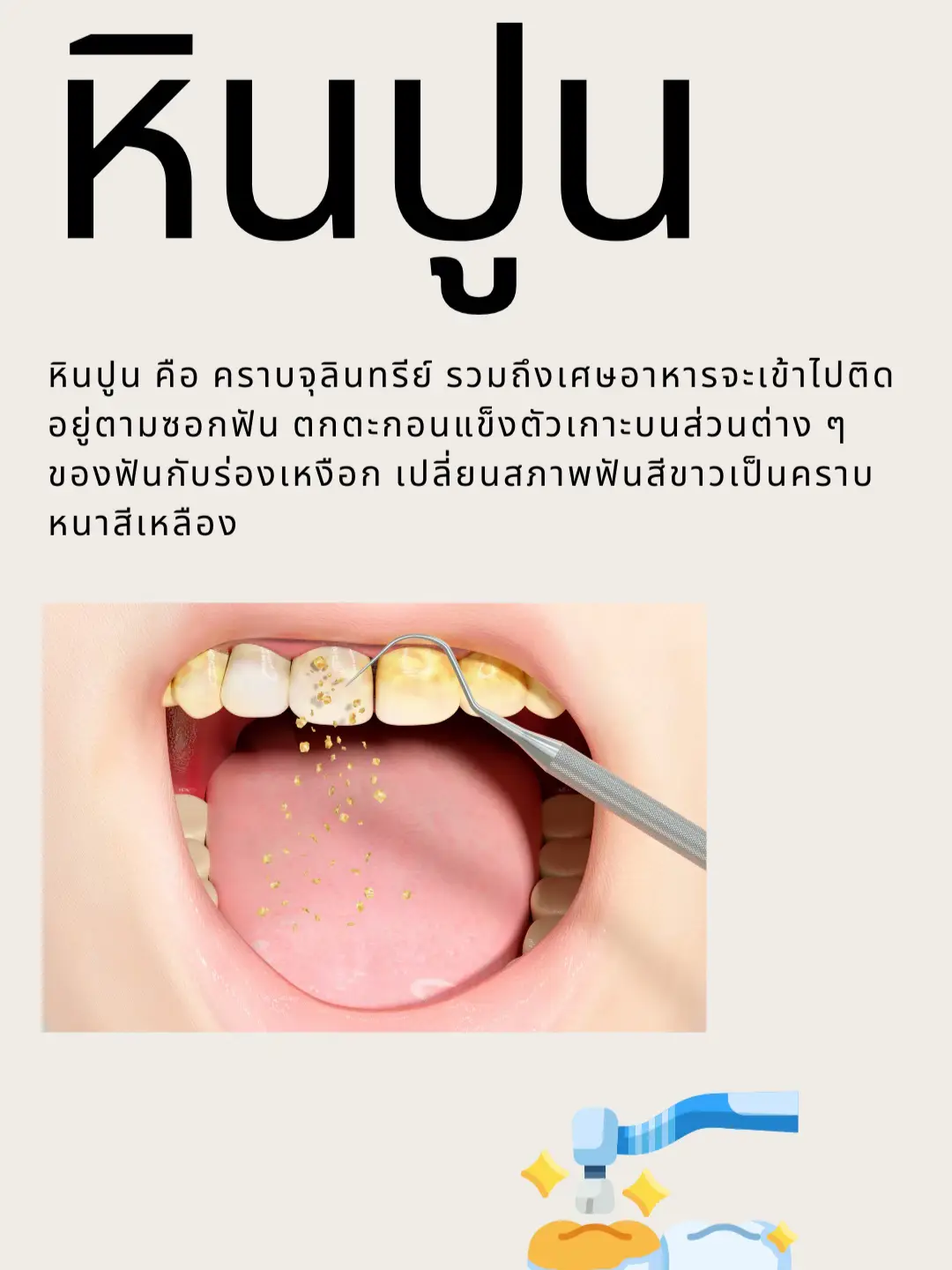 จัดฟันอยู่ขูดหินปูนได้ไหม ?? | แกลเลอรีที่โพสต์โดย Ttp Boong | Lemon8