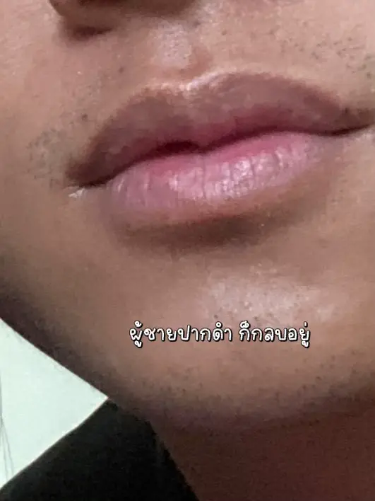 แก้ปากดำ ได้จริงดิ่ ? | แกลเลอรีที่โพสต์โดย Aunda | Lemon8