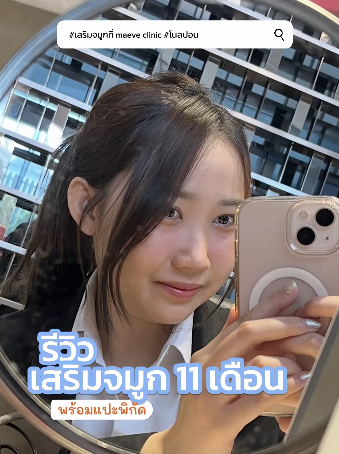 เสริมจมูก 11 เดือน ที่มาอีฟ คลินิก | แกลเลอรีที่โพสต์โดย Hello._.noon | Lemon8