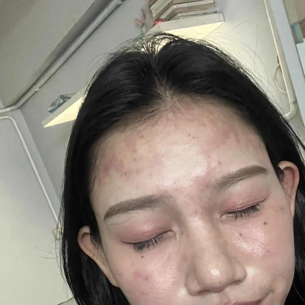 มีใครดื่มแอลกอฮอล์แล้วเป็นแบบนี้บ้าง 🥹 | แกลเลอรีที่โพสต์โดย Phannida | Lemon8