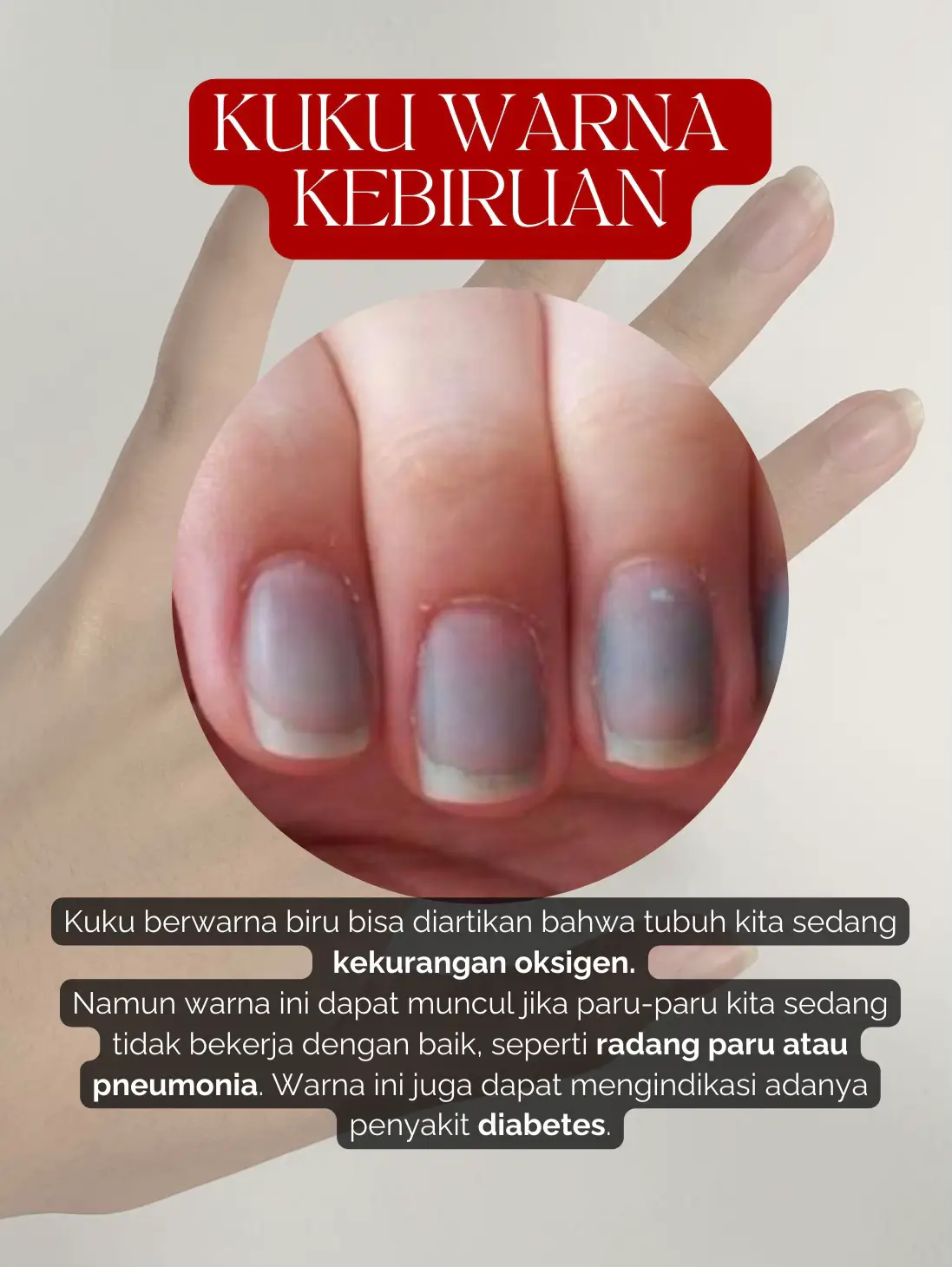 WARNA KUKU TUNJUKKAN KONDISI KESEHATANMU!⚠️😱 | Galeri diposting oleh Charmine🤍 | Lemon8