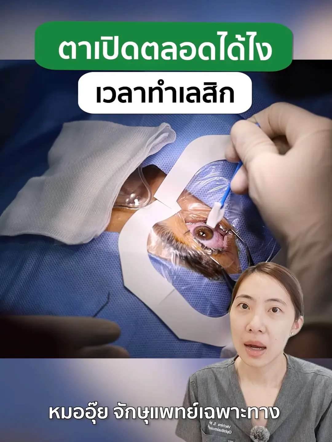 ผ่าตัดตา เราลืมตานานๆได้ไง | วิดีโอที่เผยแพร่โดย dr.ouise.eyes | Lemon8